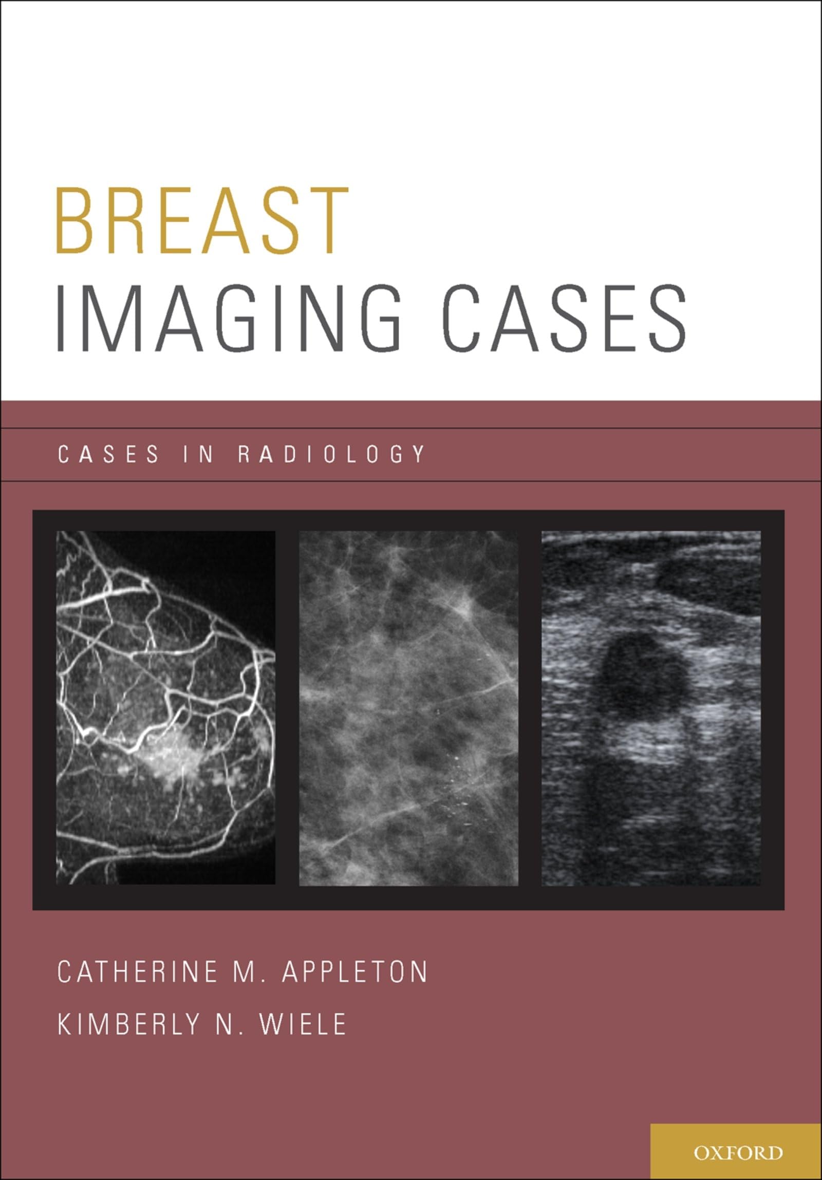 Breast Imaging Cases (Cases in Radiology): 9780199731923: Medicine ...