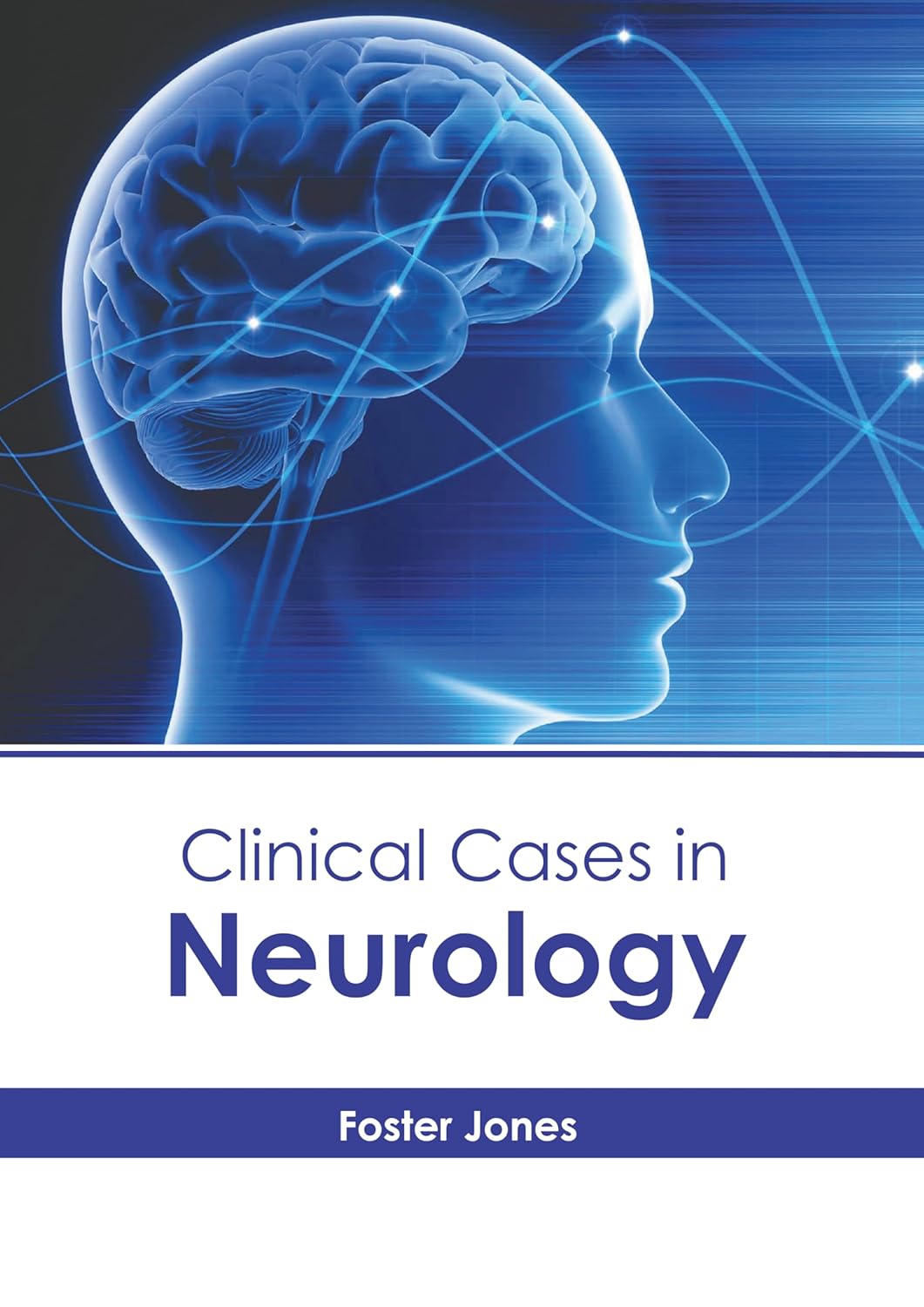 Clinical Cases in Neurology: 9798887406312: Medicine & Health Science ...