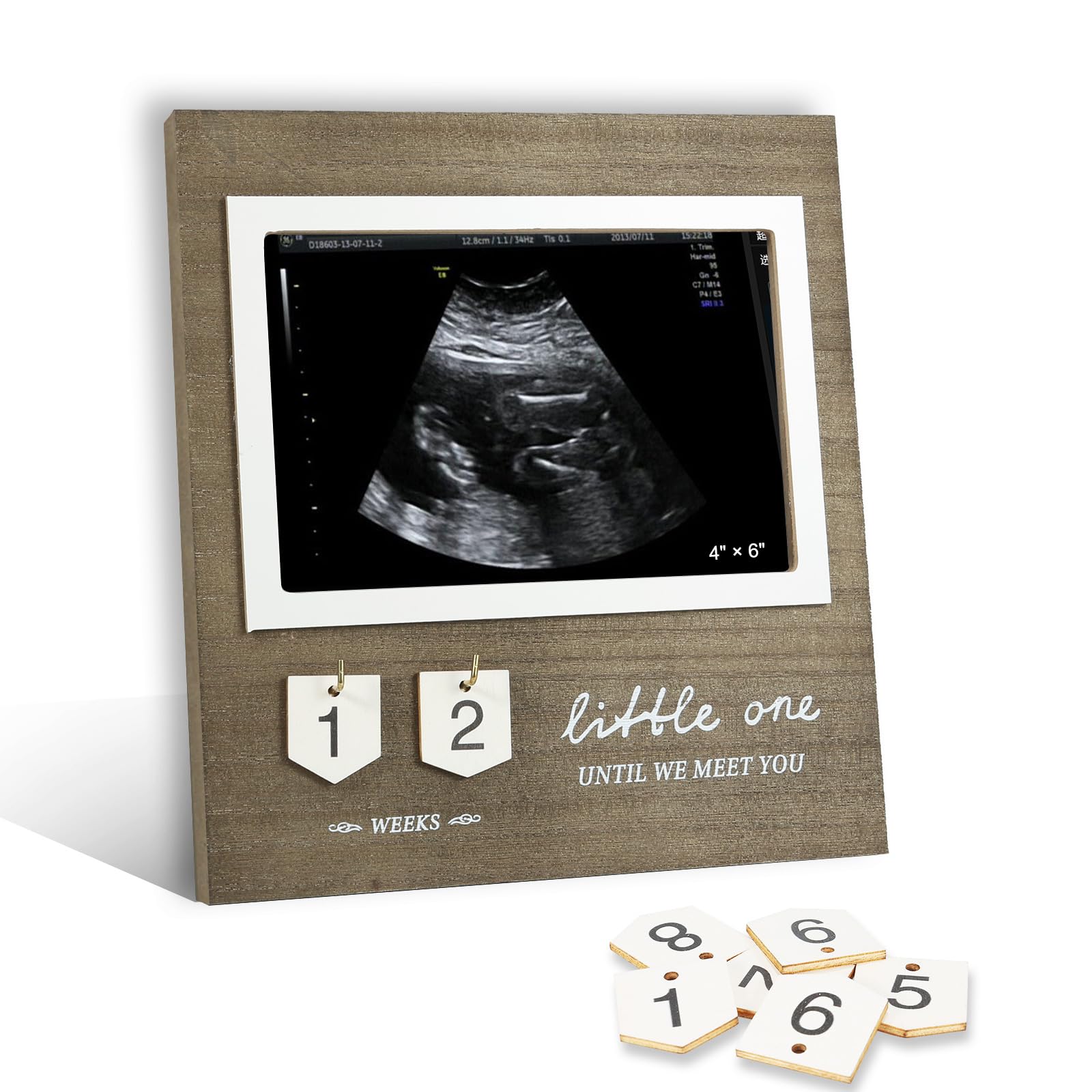 Amazon.com: Homeny Baby Countdown Ultrasound Photo Frame, Pregnancy ...
