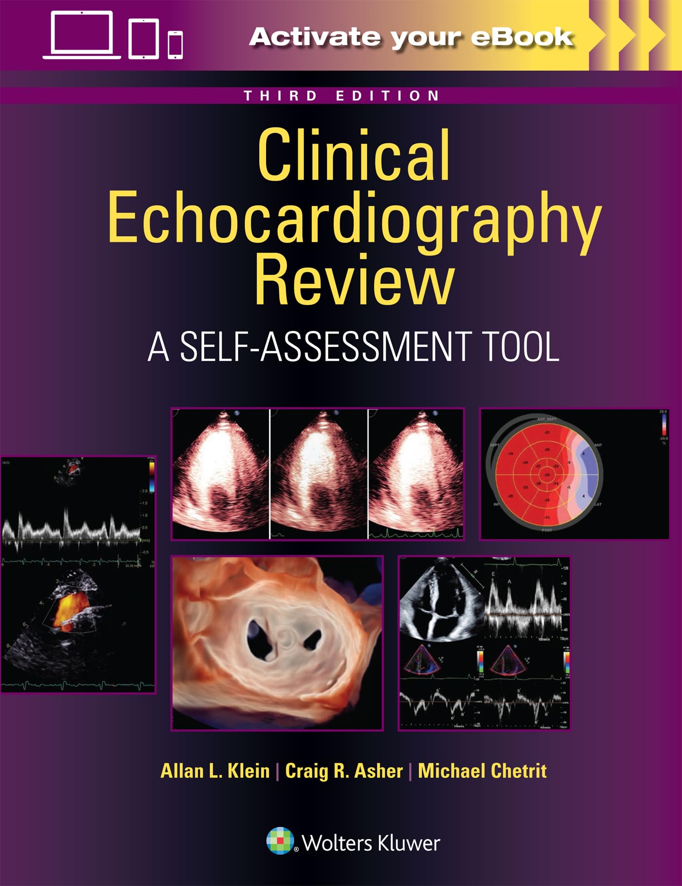 Clinical Echocardiography Review: A Self-Assessment Tool: Print + eBook ...