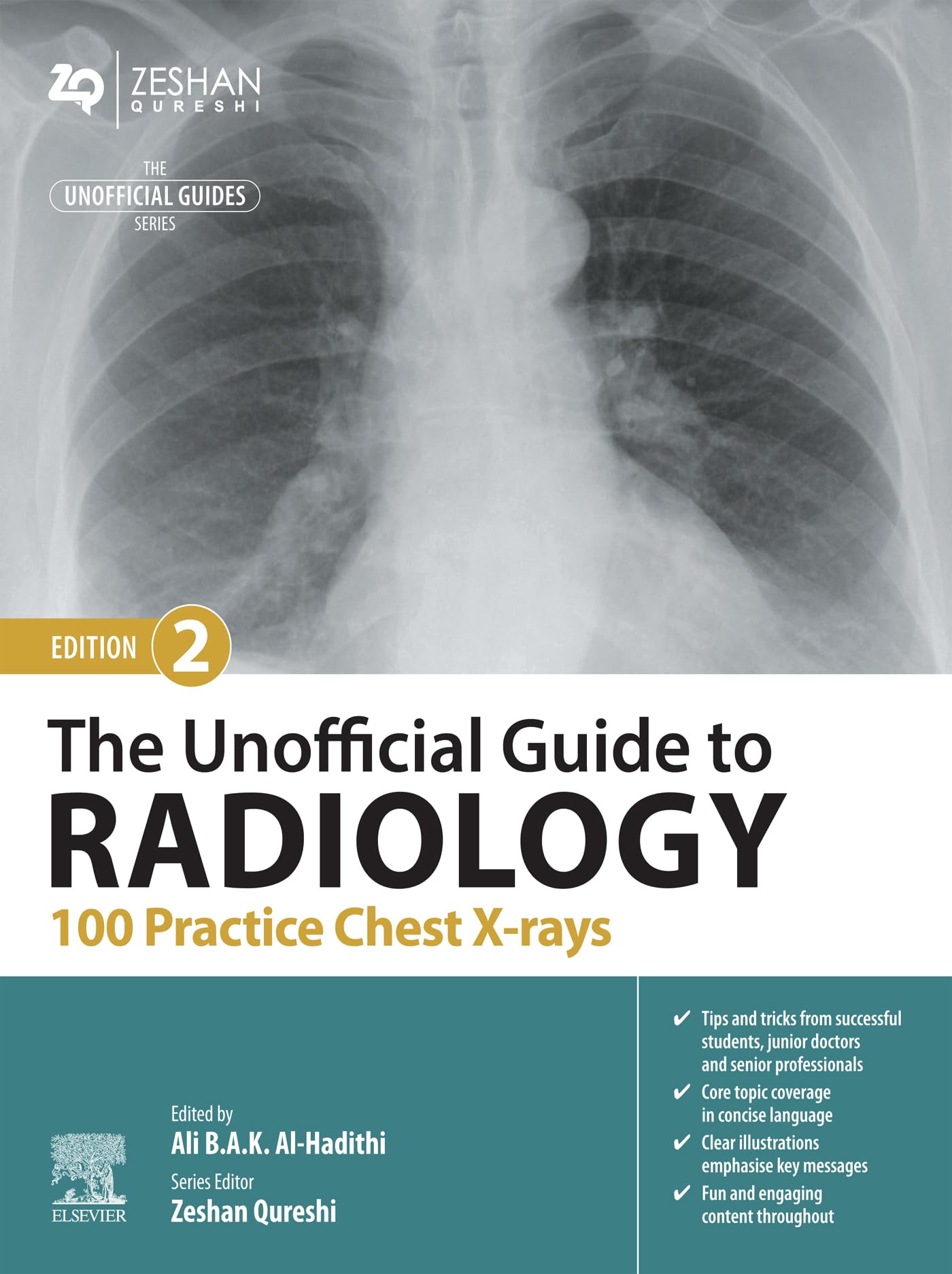 Buy The Unofficial Guide to Radiology: 100 Practice Chest X-rays ...