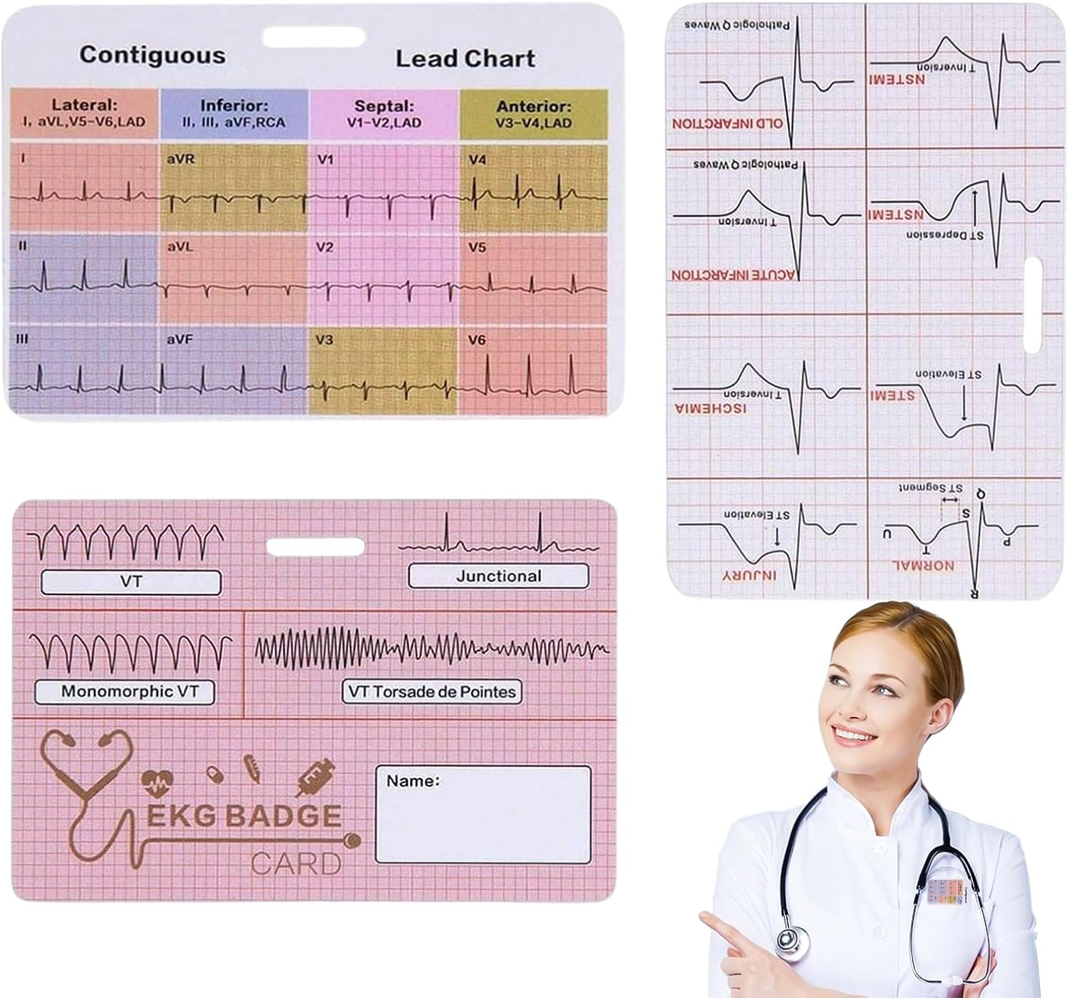 Interpretazione ECG, distintivo ECG – ECG Pocket Guide | 3 X ECG ...