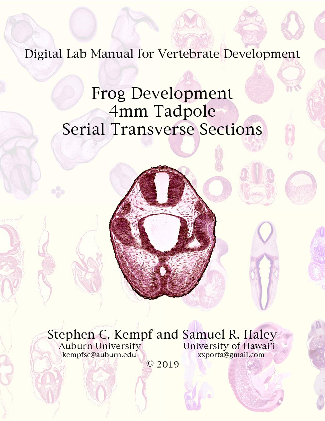 Amazon | 4mm Frog Tadpole Serial Transverse Sections: Digital Lab ...