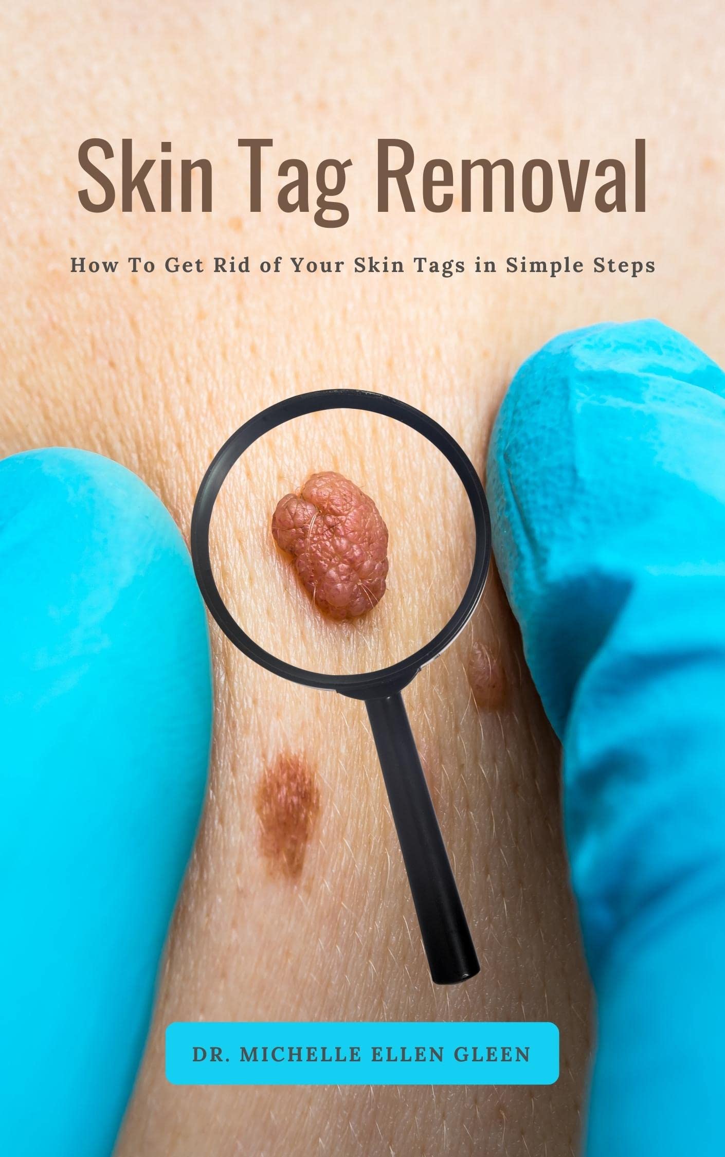 Buy Skin Tag Removal : How To Get Rid of Your Skin Tags in Simple Steps ...