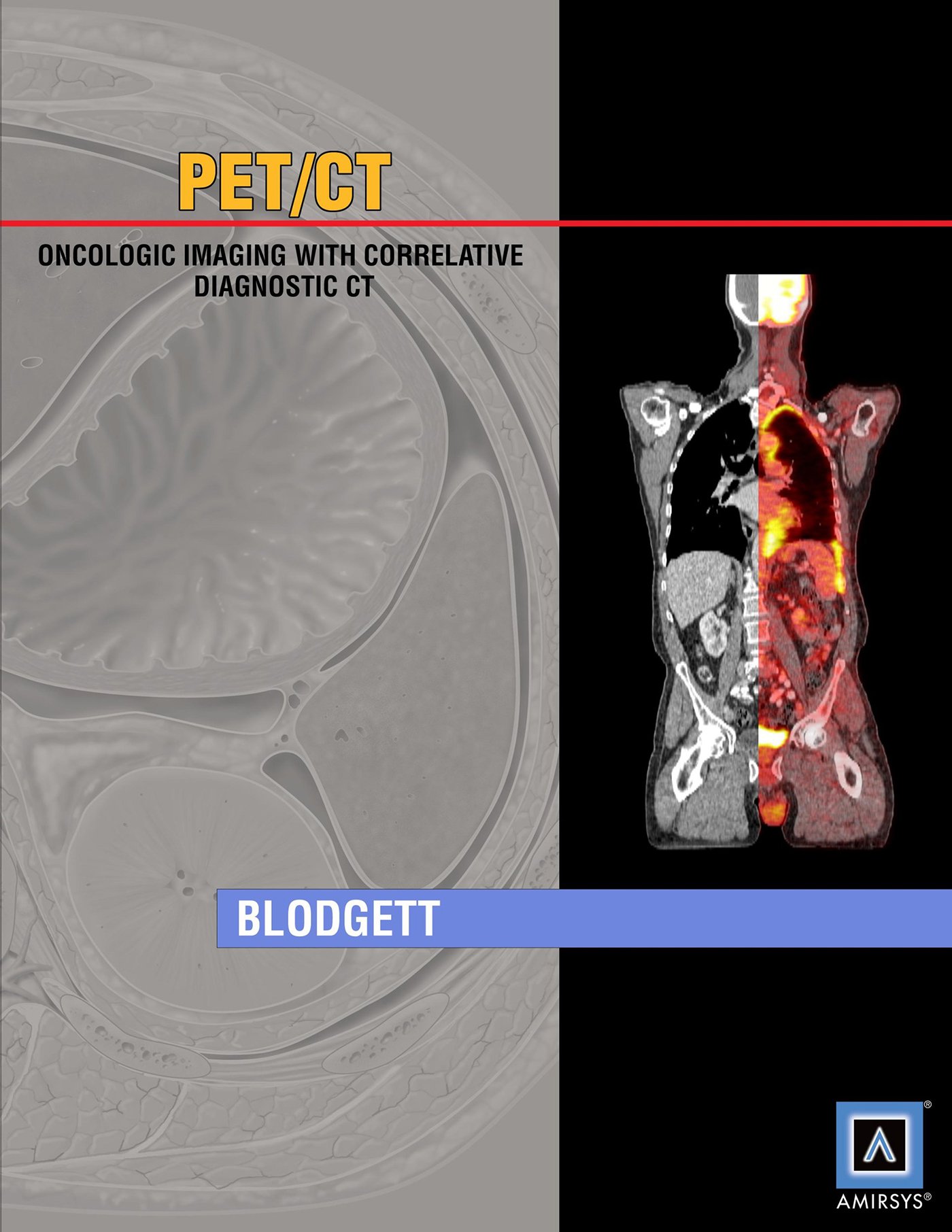 Specialty Imaging PET/CT: Oncologic Imaging with Correlative Diagnostic ...