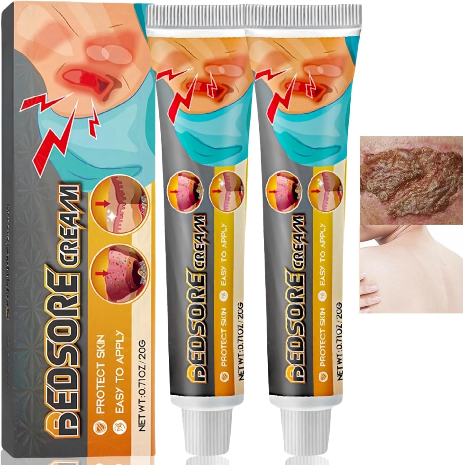 2Pcs Bed Sore Cream,Pressure Sore Cream,Bed Sore Wound Treatment Cream ...