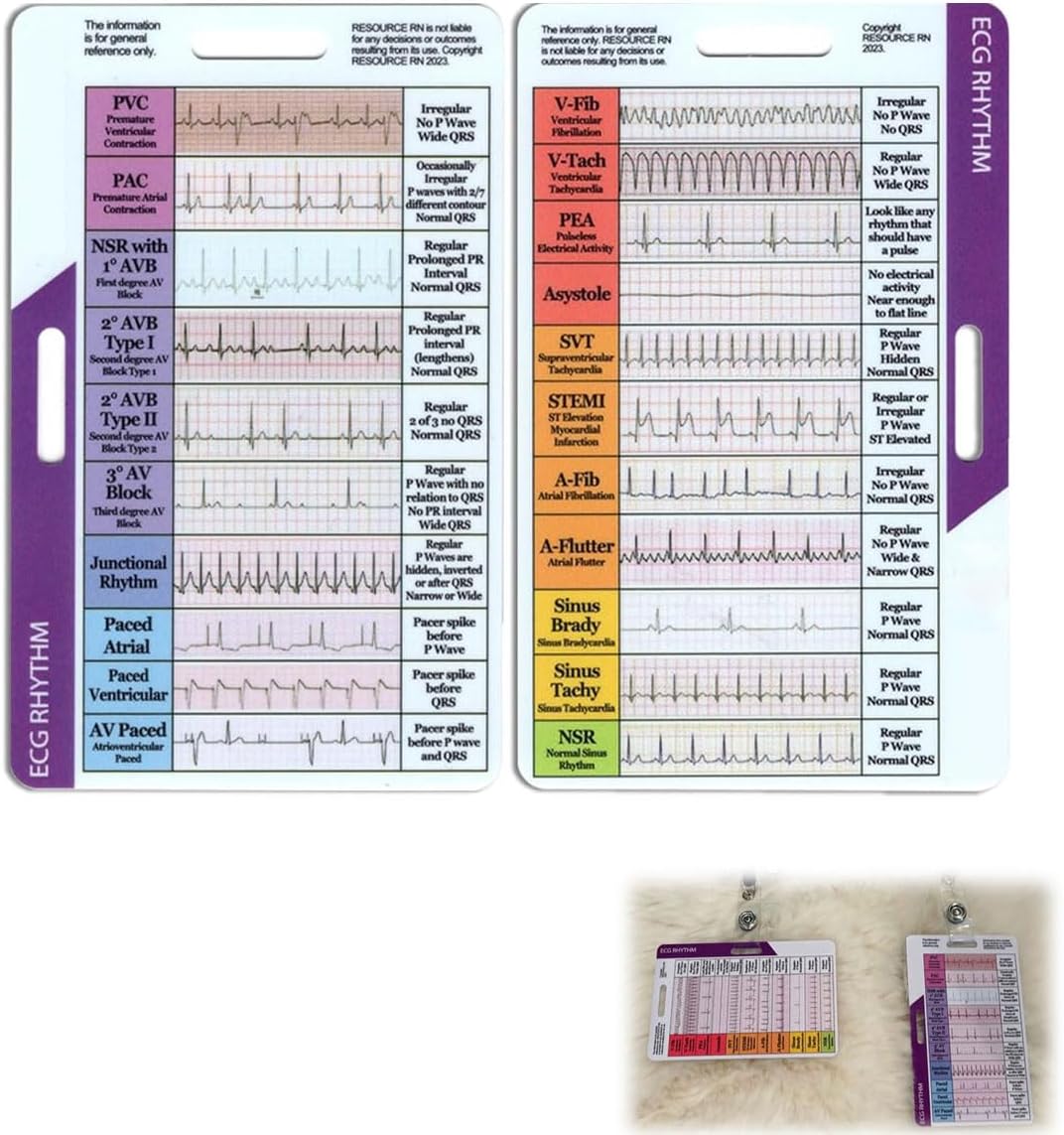 ECG/EKG Rhythm Pocket Card, Double Sided Design EKG Rhythm ...