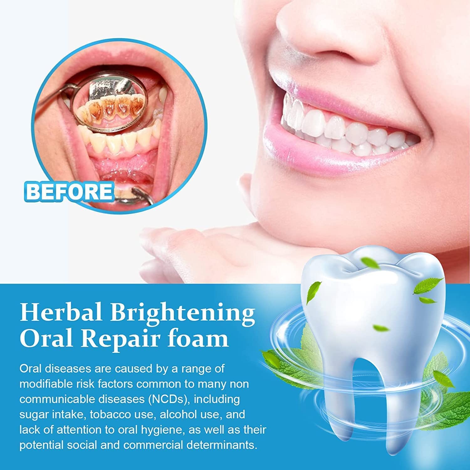 Human Foaming At The Mouth