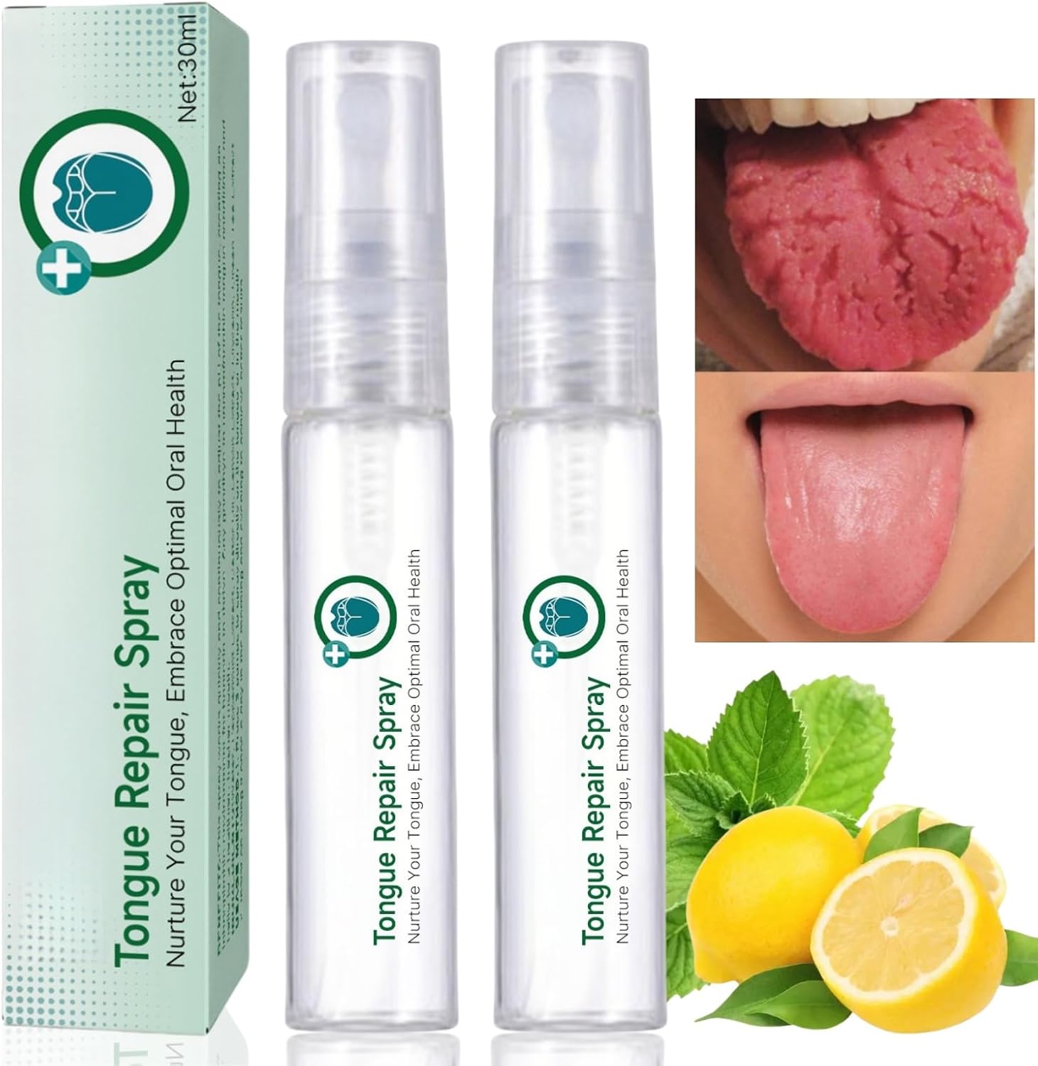 2Pcs Tongue Repair Spray,Fissured Tongue Relief Spray,Reduce Swelling ...