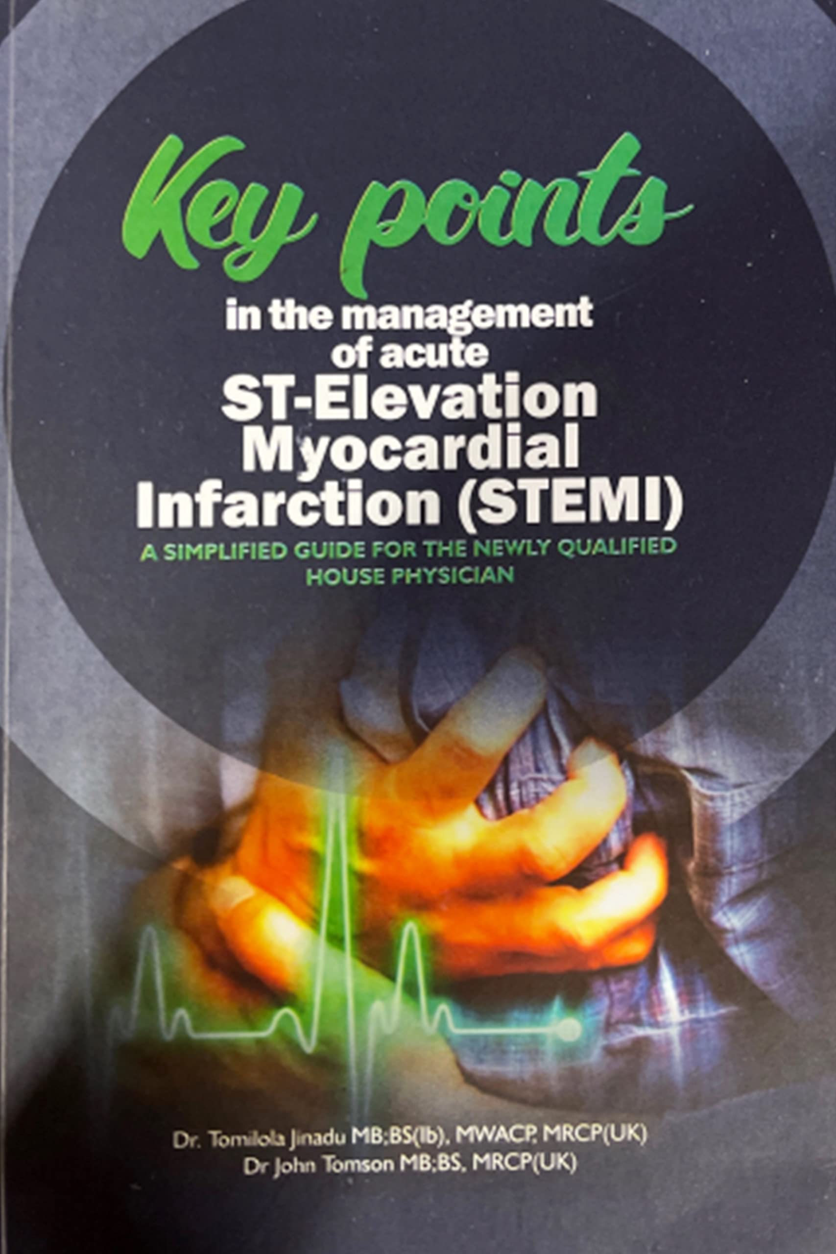 Buy Keypoints in the management of acute ST-Elevation Myocardial ...