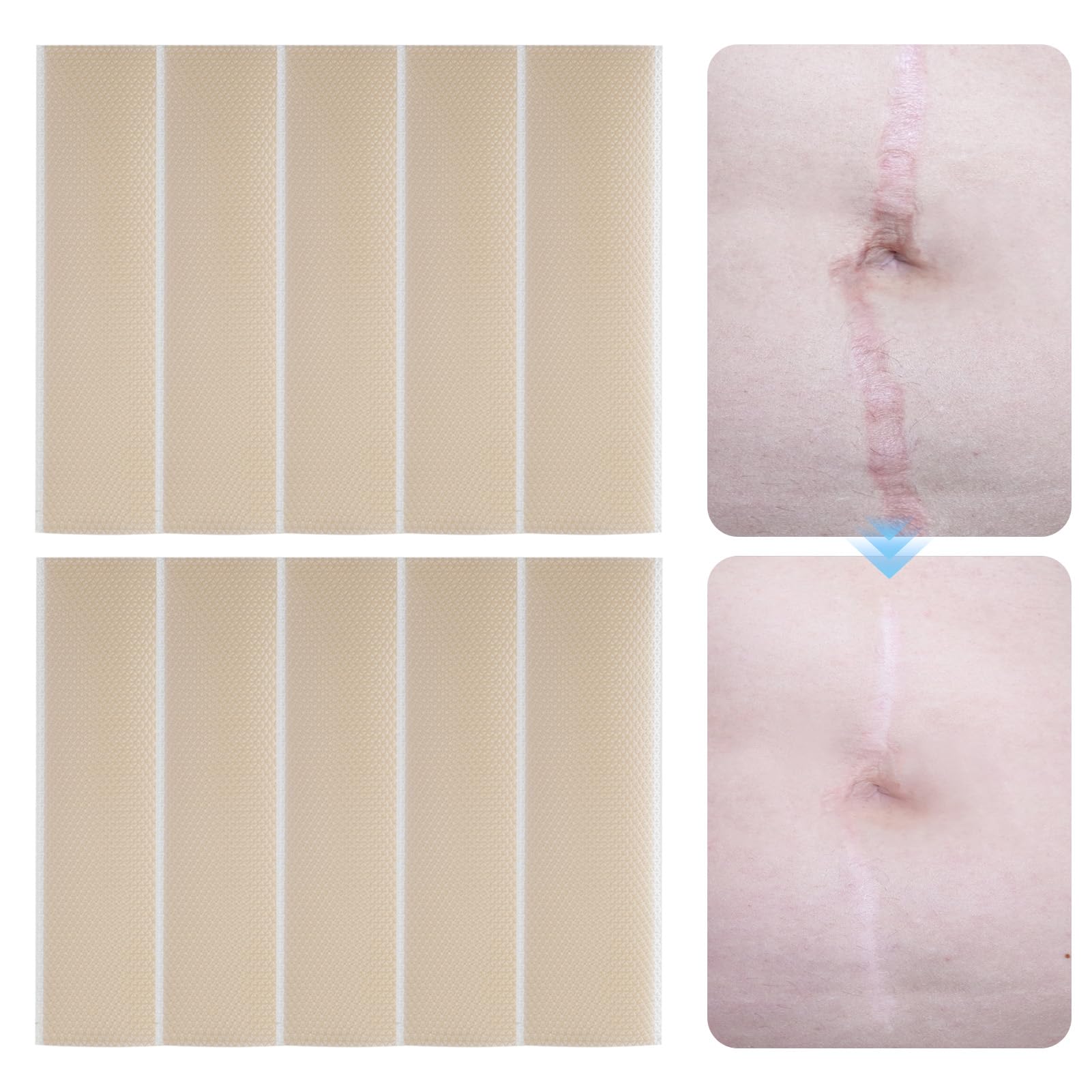 Buy 10Pcs 4cm x 1.5m Silicone Sheets, Medical Grade s Tape Professional ...