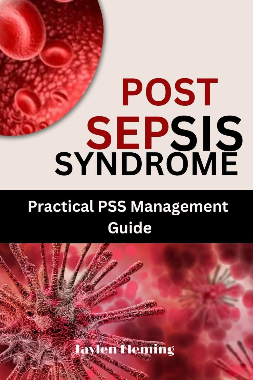 POST SEPSIS SYNDROME: Practical PSS Management Guide (Sepsis Syndrome ...
