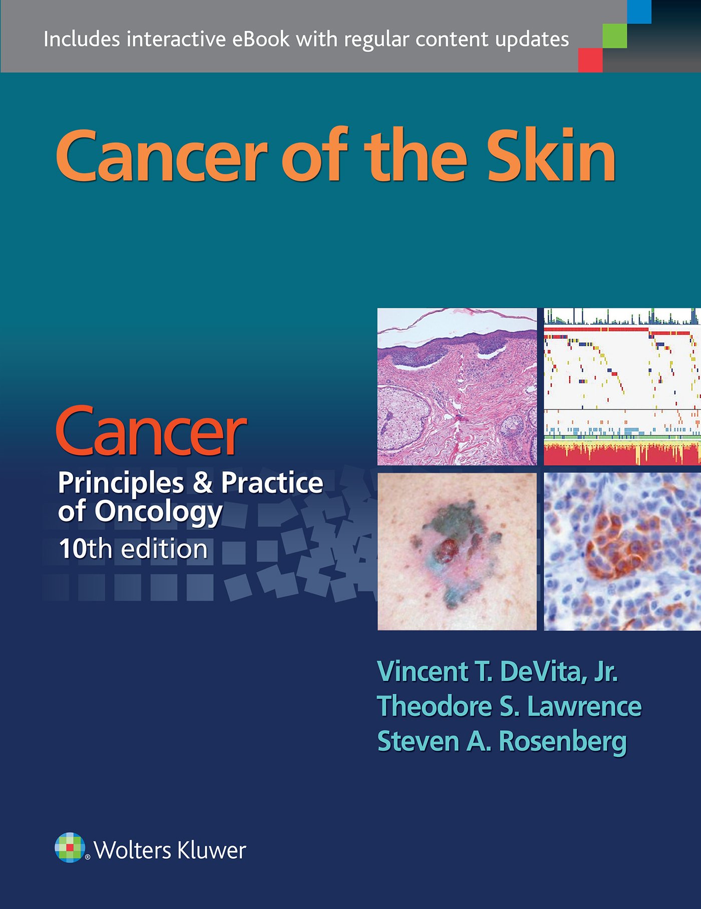 Cancer of the Skin: Cancer: Principles & Practice of Oncology, 10th ...