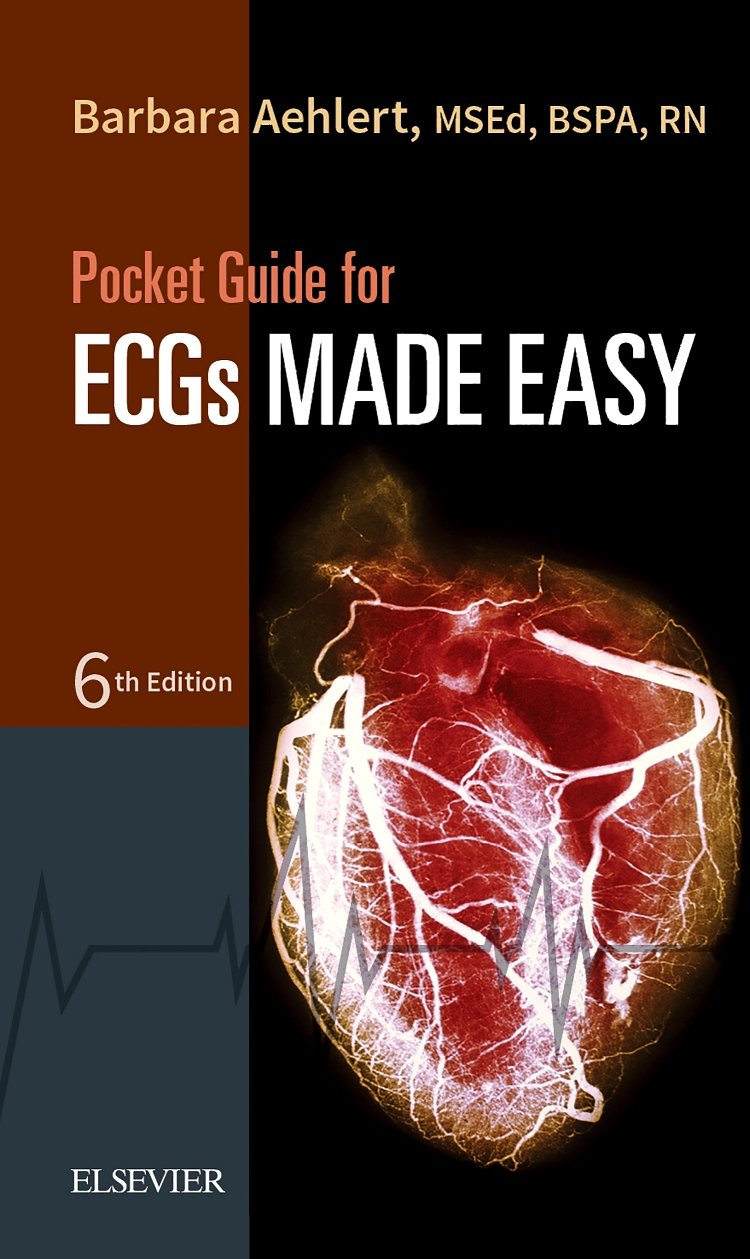 Pocket Guide for ECGs Made Easy: Amazon.co.uk: Aehlert MSEd BSPA RN ...