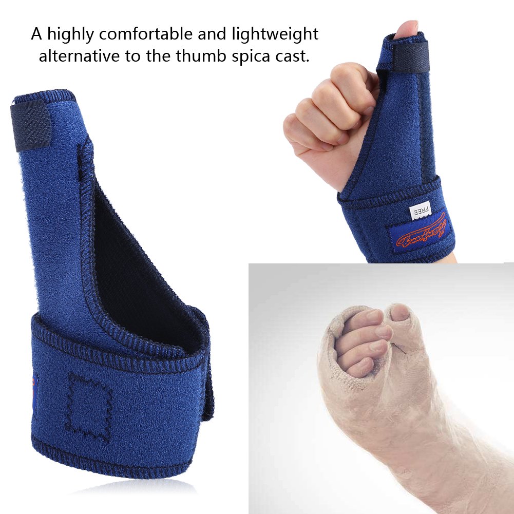 Finger Spica Cast Short Ulnar Gutter Cast For Gameplay. (a) With The