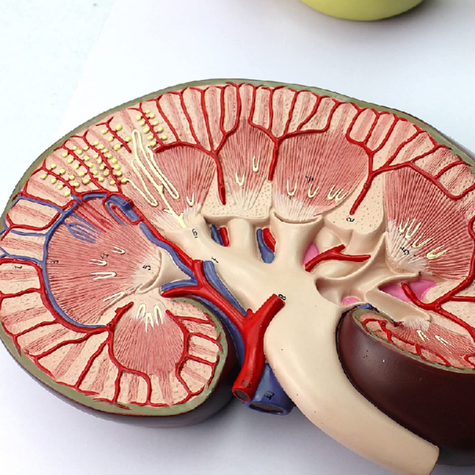 Anatomia Do Rim Nefron Urolithiasis | Radiology Reference Article