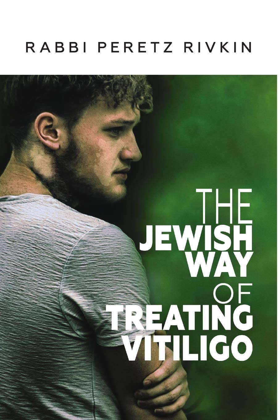 The Jewish Way of Treating Vitiligo: Rivkin, Rabbi Peretz ...