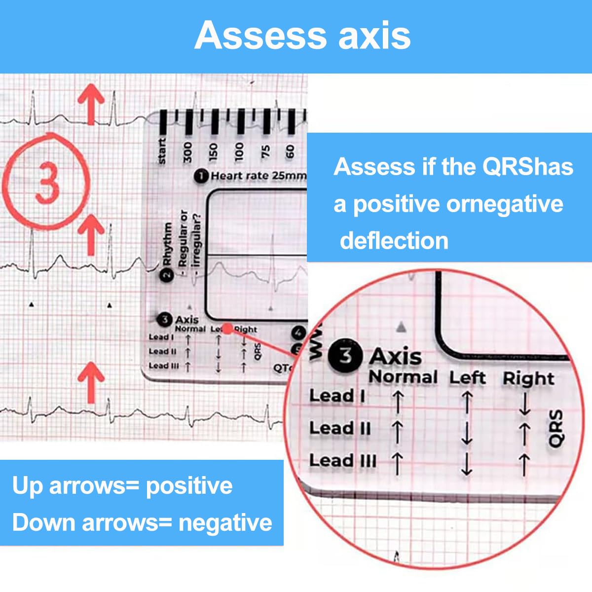 Snapklik.com : ECG 7 Step Ruler For EKG Interpretation - Transparent ...