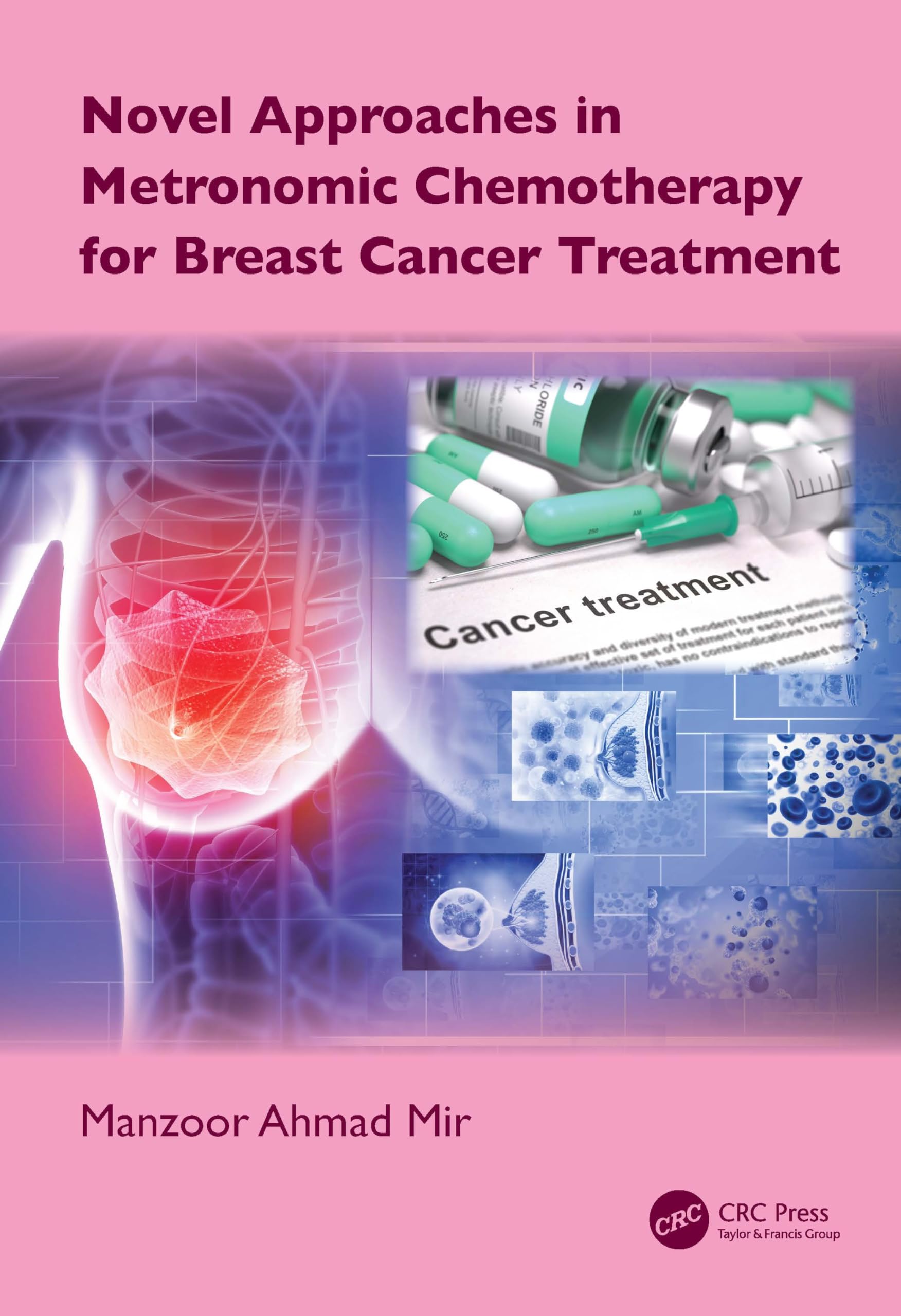 Novel Approaches in Metronomic Chemotherapy for Breast Cancer Treatment ...