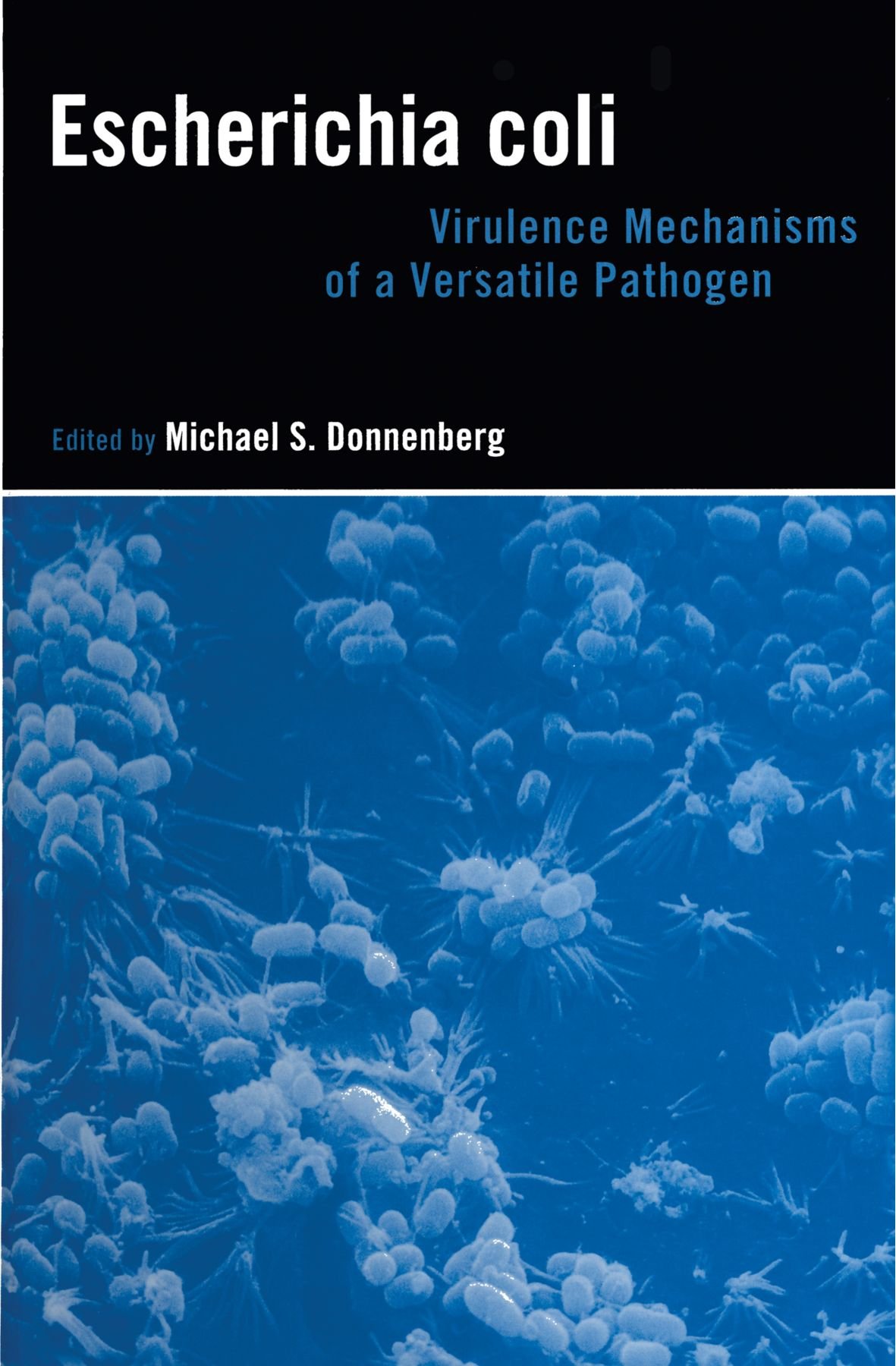Escherichia coli: Virulence Mechanisms of a Versatile Pathogen ...