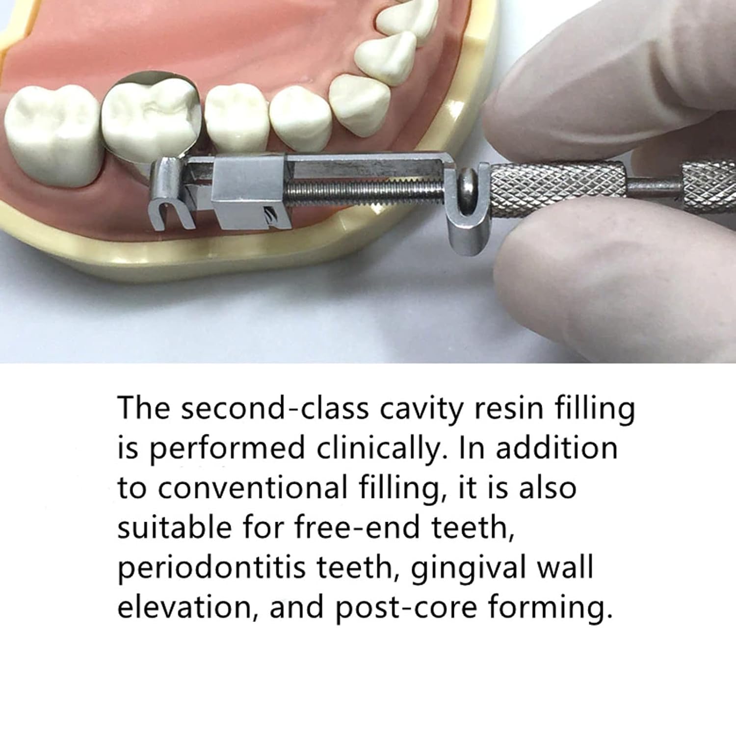 Bandas de matriz dental, retenedor de matriz de tofflemire de acero ...
