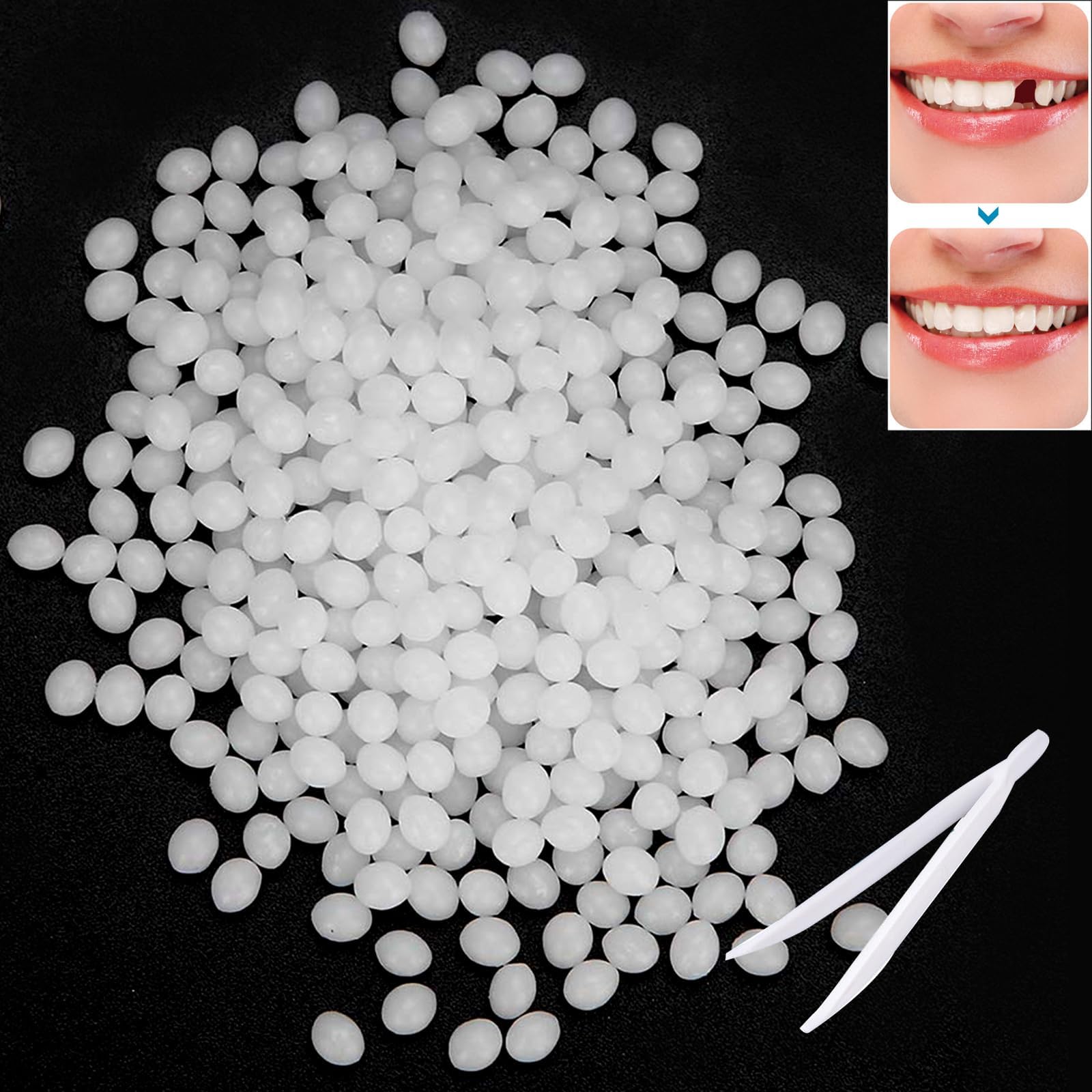 Amazon.com: Tooth Repair Kit, 100 g Moldable Thermal Fitting Beads for ...