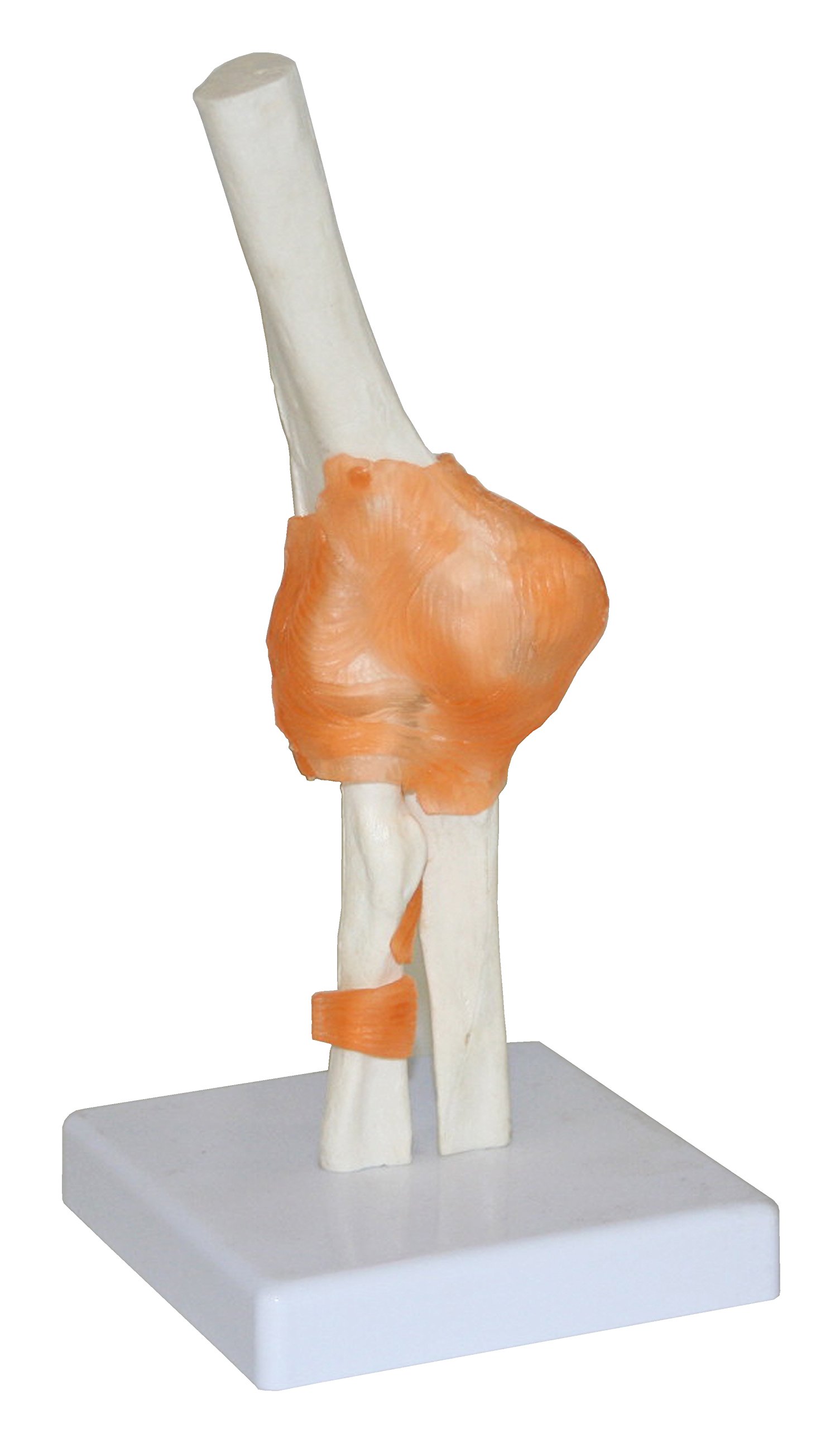 Vision Scientific Vaj234 Classic Functional Elbow Joint Articulate With ...