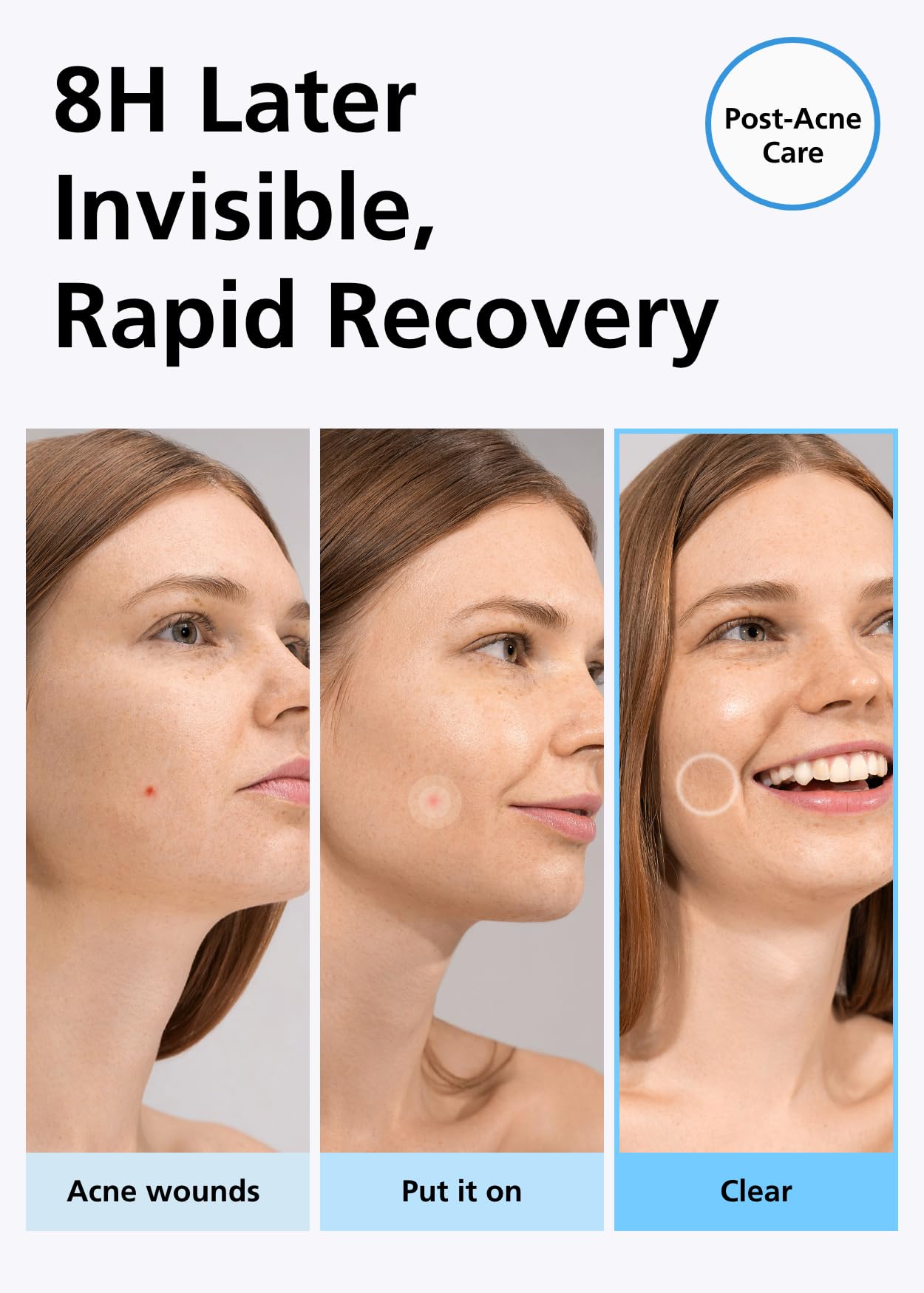 Snapklik.com : EasyDerm Beauty Patch