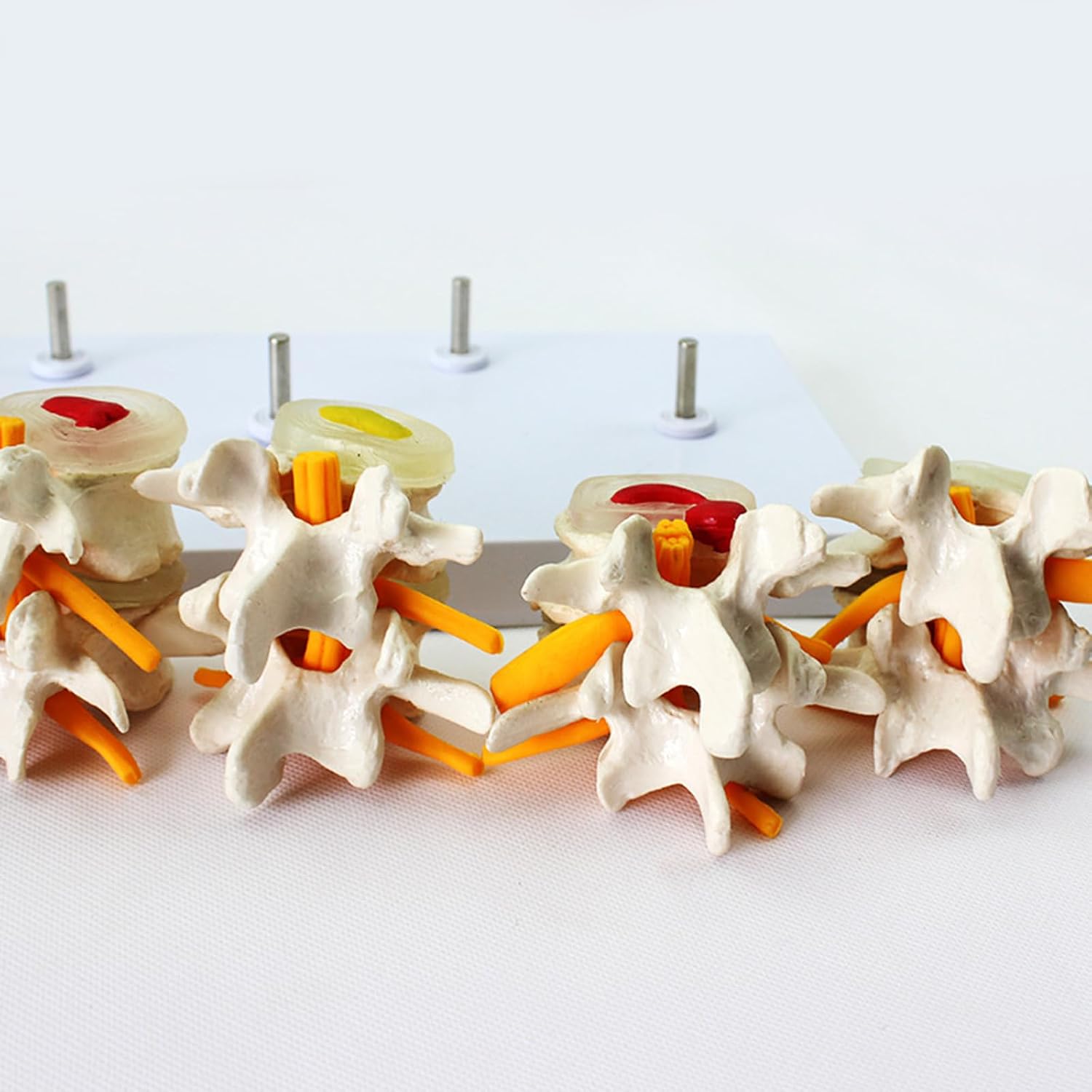 Human Lumbar Spine Medical Model, Four-Stage Lumbar Bahrain | Ubuy