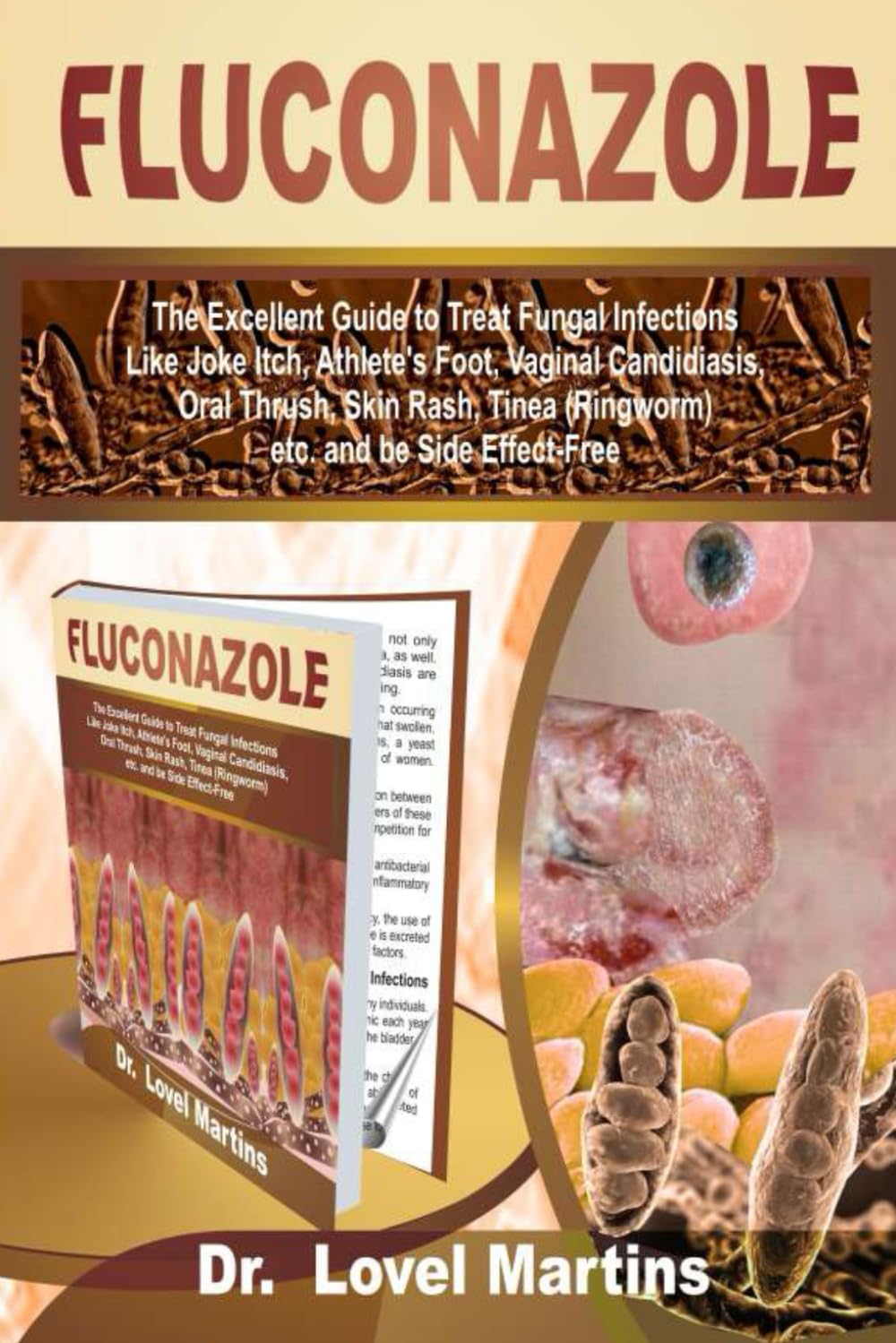 Fluconazole The Excellent Guide To Treat Fungal Infections Like Joke ...