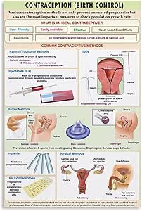 Amazon.com: BLUDUG Contraception Birth Control Poster Hospital Poster ...