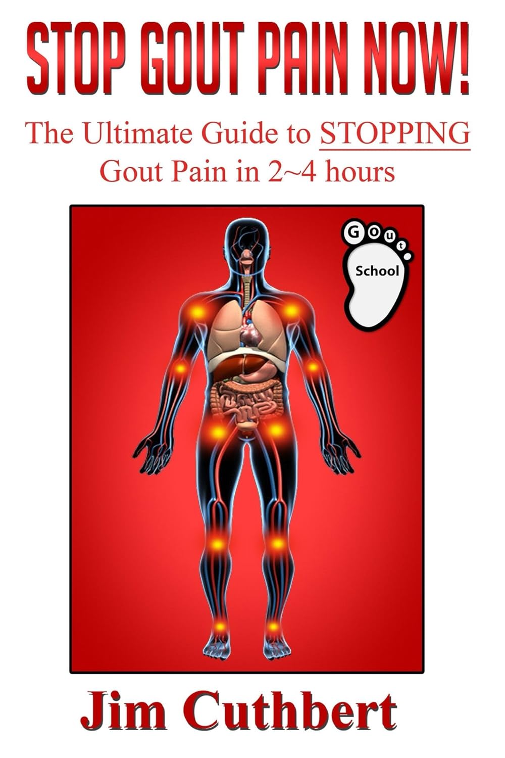 Gout: Stop Gout Pain Now!: The Ultimate Guide to STOPPING Gout Pain in ...