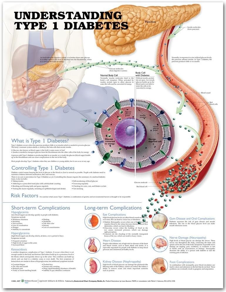 Amazon.com: Understanding Type 1 Diabetes Anatomical Chart : Anatomical ...