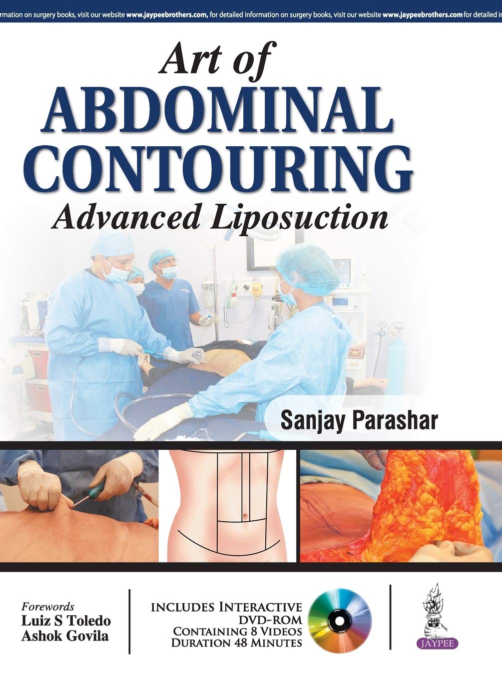 Art of Abdominal Contouring: Advanced Liposuction: 9789352500239 ...