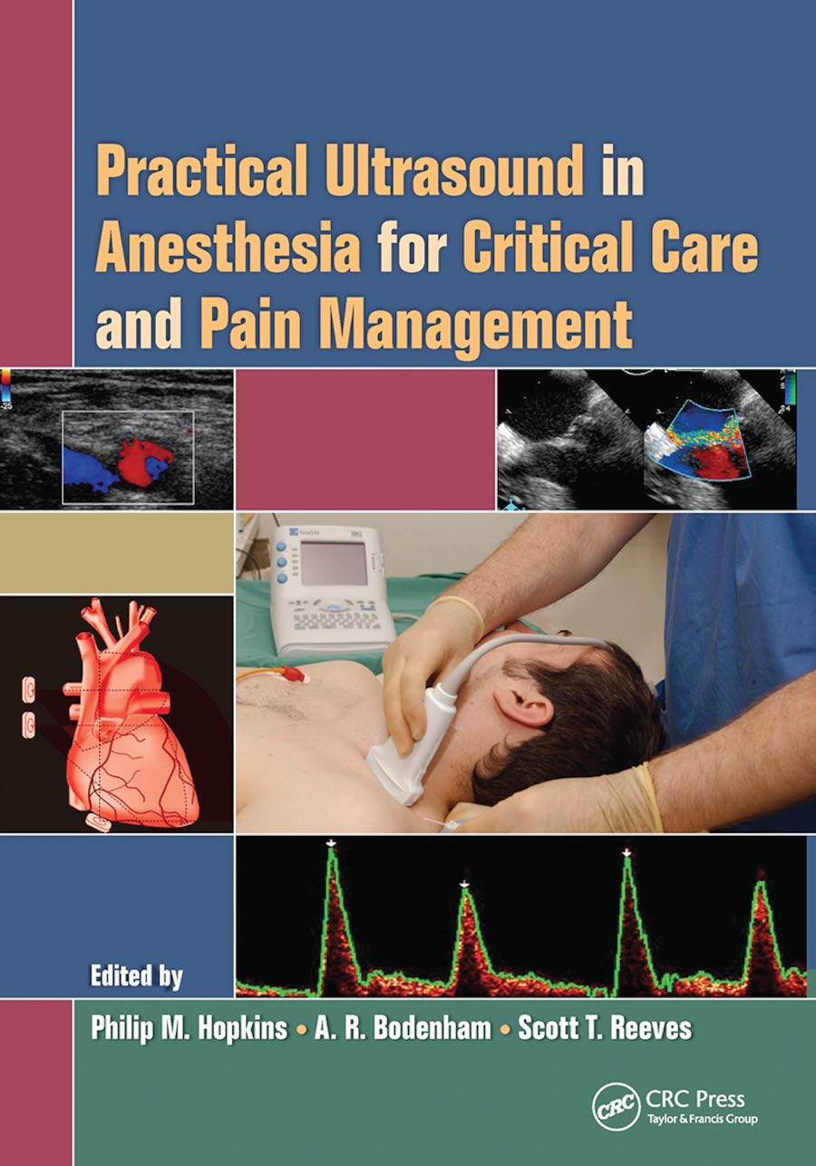 Practical Ultrasound in Anesthesia for Critical Care and Pain ...