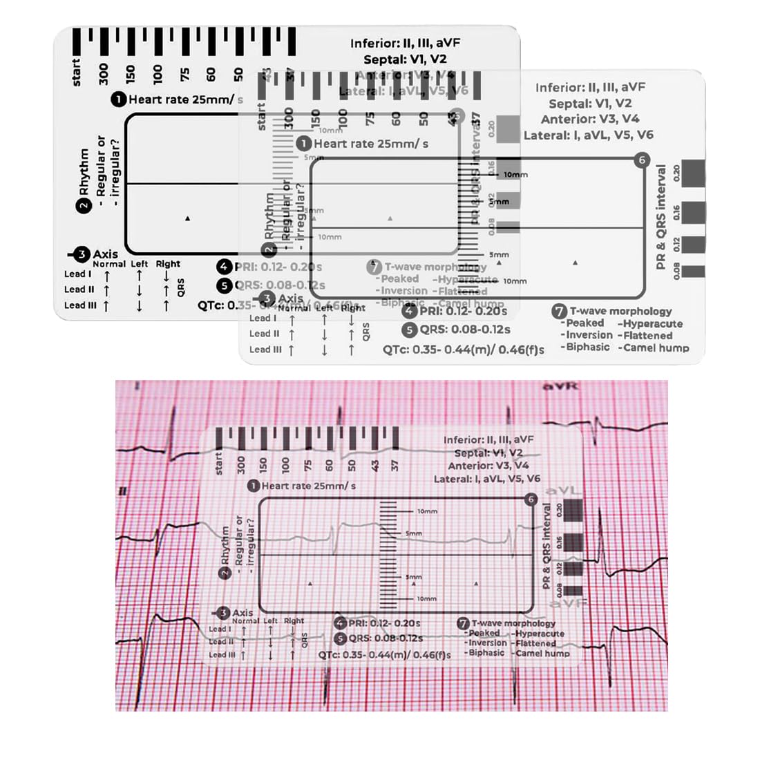 2 Pack ECG 7 Step Ruler for ECG EKG Interpretation - Portable ECG ...