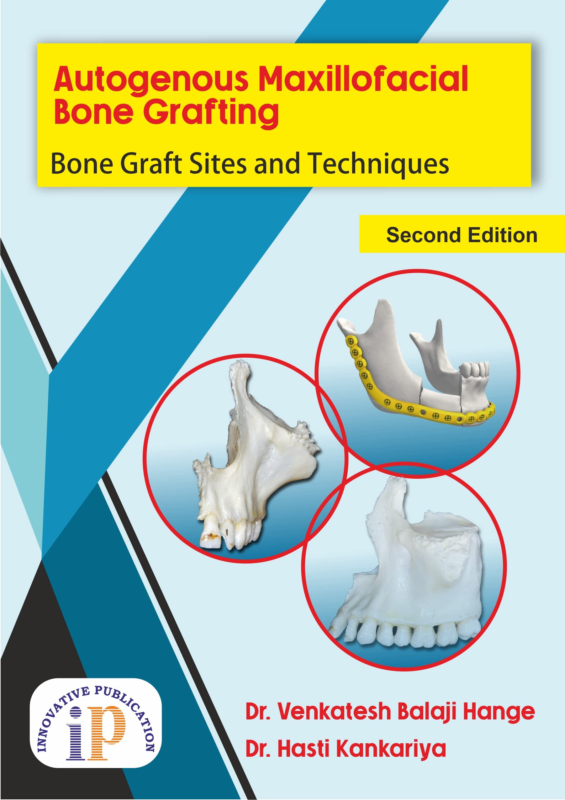 Buy Autogenous Maxillofacial Bone Grafting: Bone Graft Sites and ...