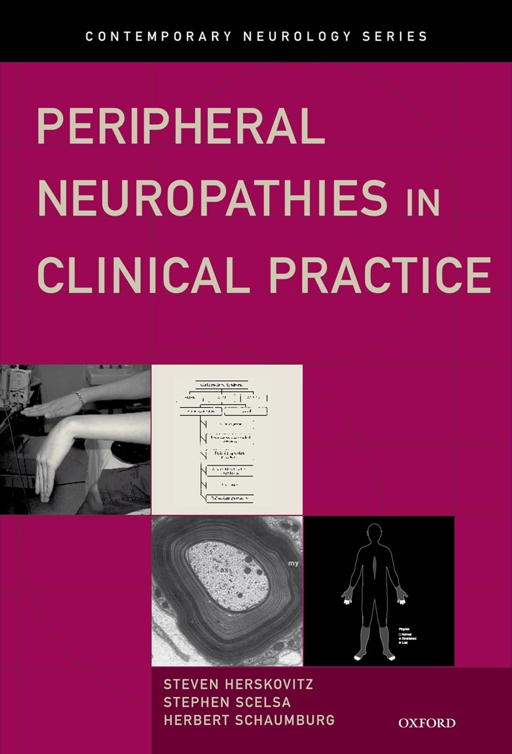 Amazon.com: Peripheral Neuropathies in Clinical Practice (Contemporary ...