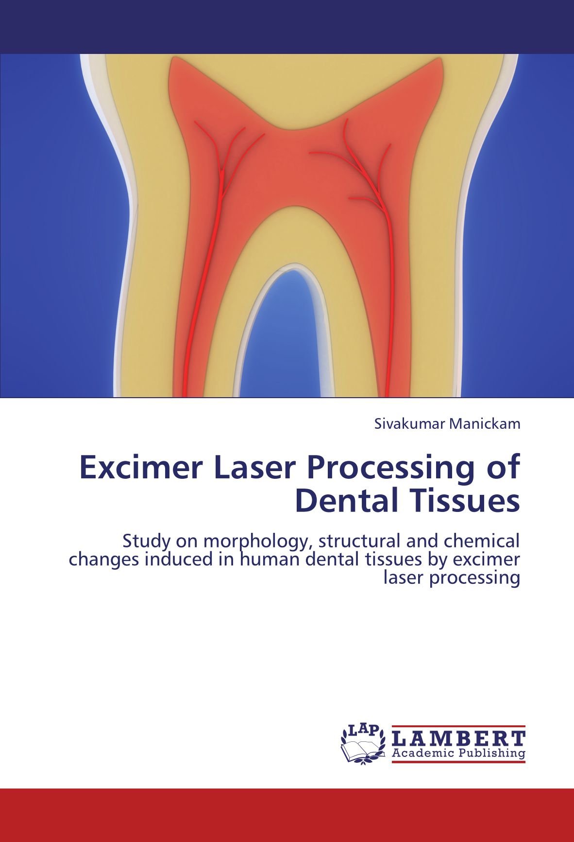 Buy Excimer Laser Processing of Dental Tissues: Study on morphology ...