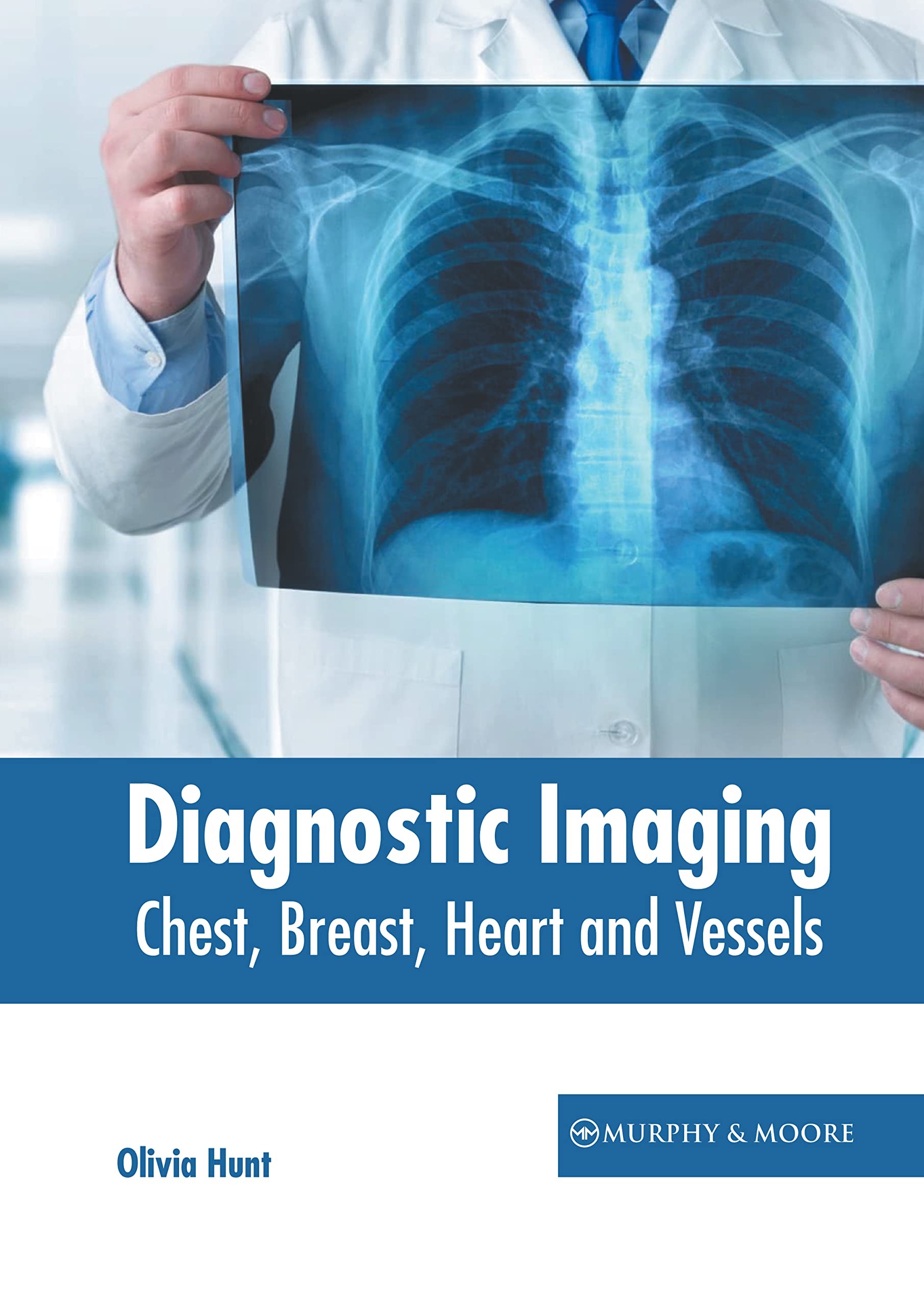Diagnostic Imaging: Chest, Breast, Heart and Vessels: 9781639871599 ...