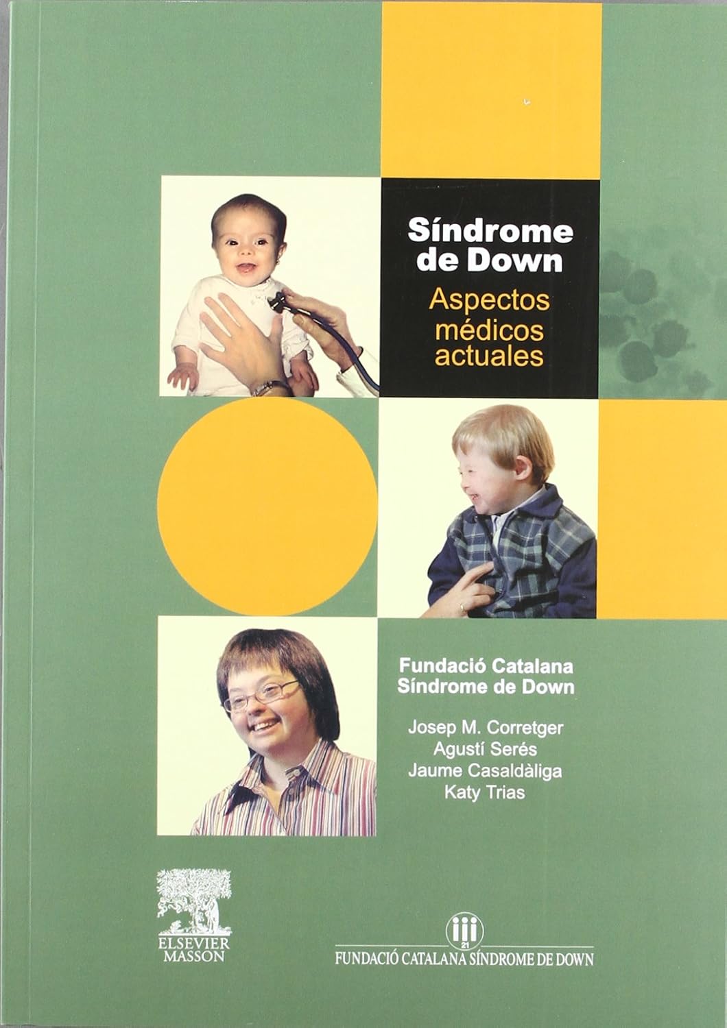 Amazon.com: Síndrome de Down: Aspectos médicos actuales: 9788445815045 ...