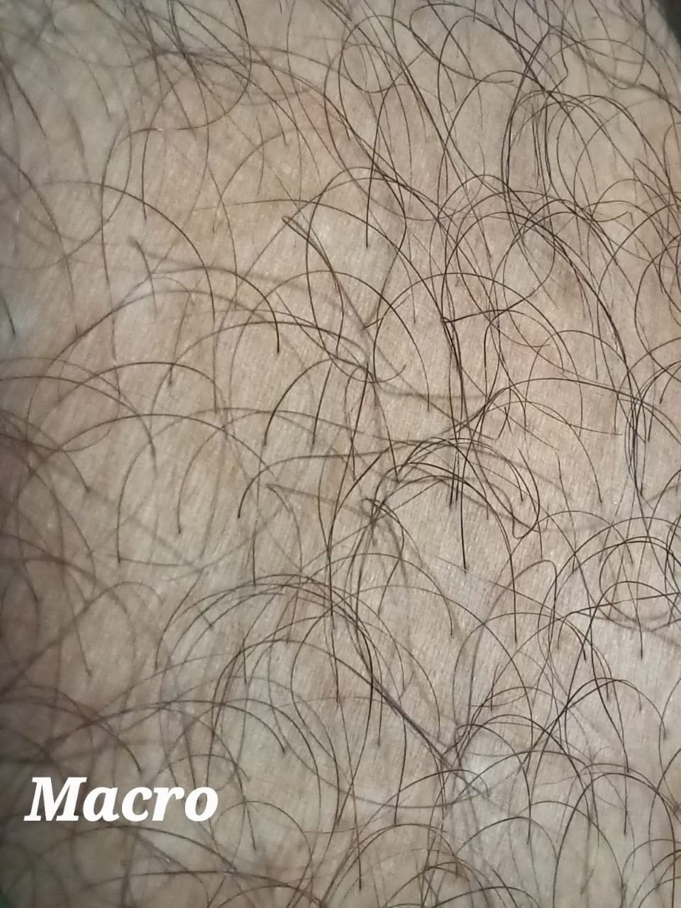 Samsung Galaxy M32 (Light Blue, 4GB RAM, 64GB | FHD+ sAMOLED 90Hz ...