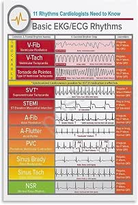 EKG & Basic Heart Rhythms Chart - Educational Medical Poster for ...