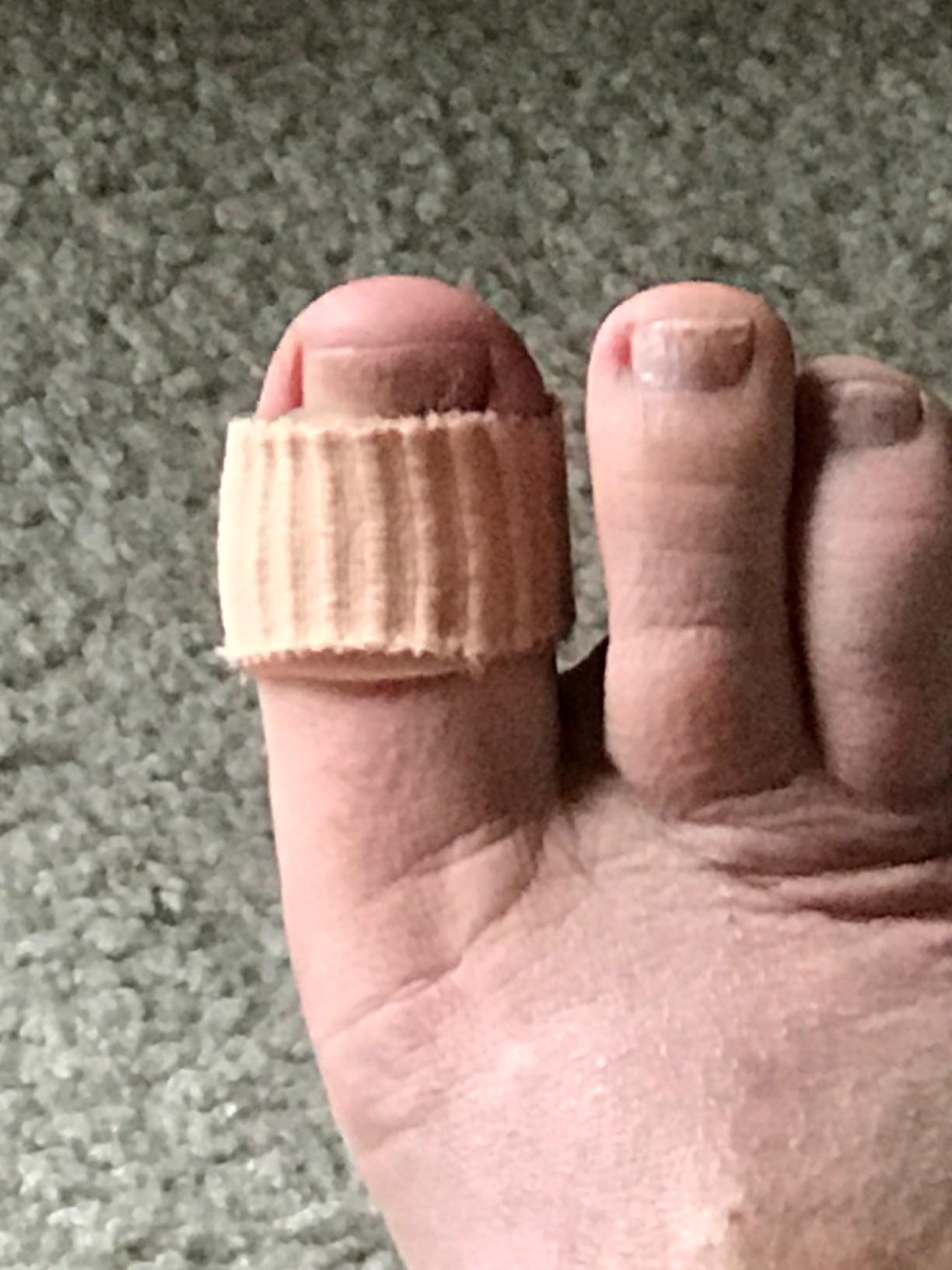 Amazon.com: Silipos TheraStep 7006 Gel Toe Tubes - Washable One Sized ...