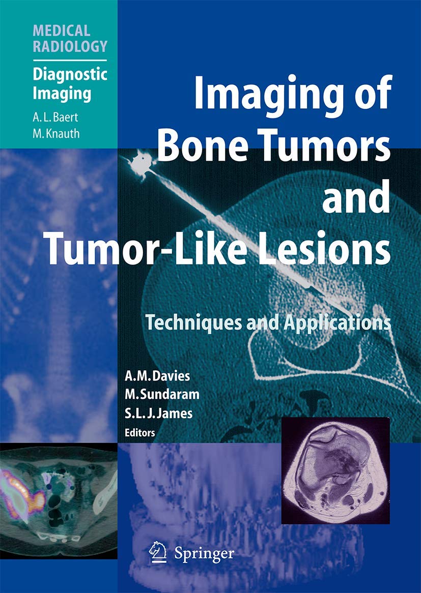 Imaging of Bone Tumors and Tumor-Like Lesions: Techniques and ...