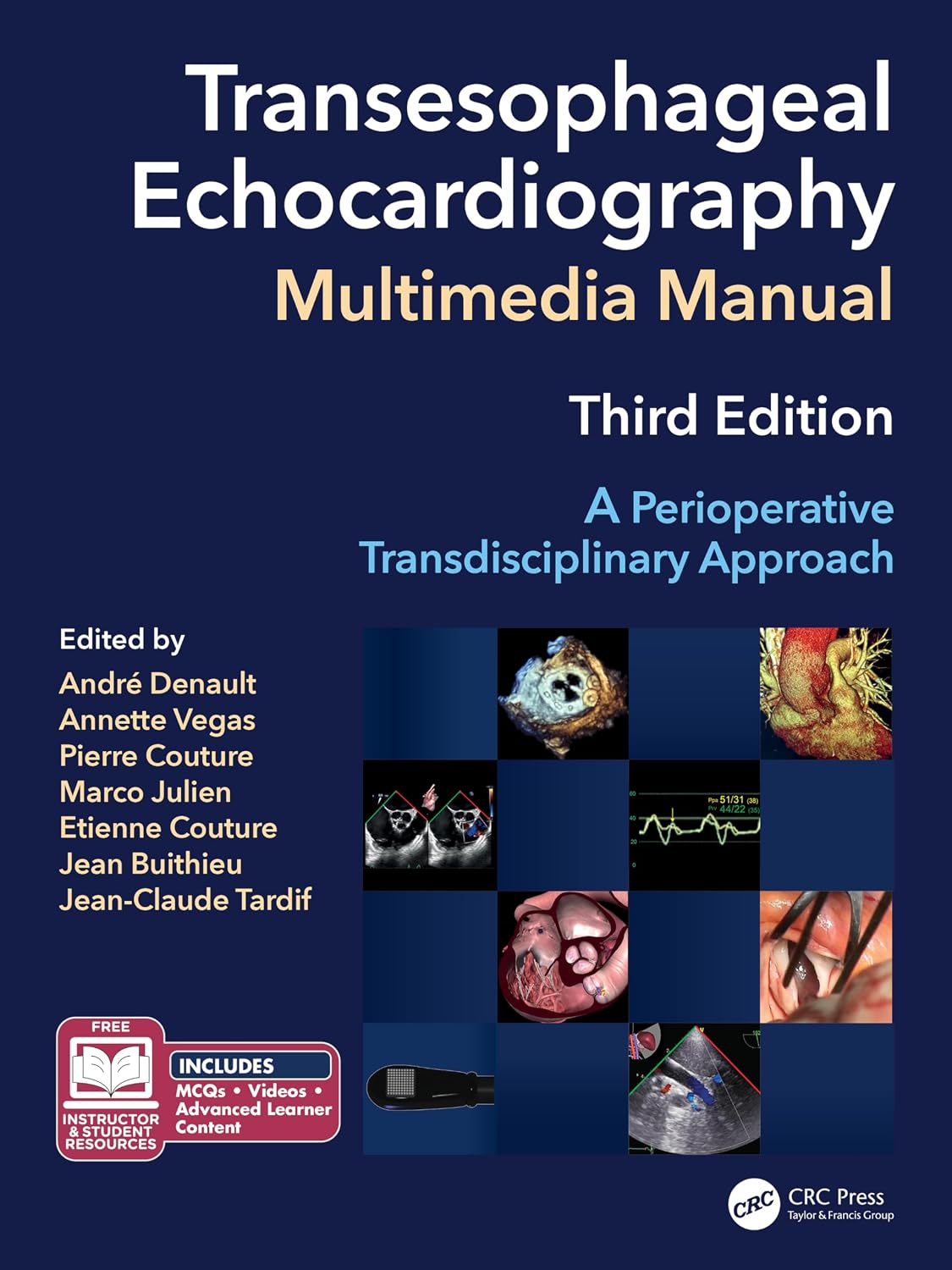 Transesophageal Echocardiography Multimedia Manual: A Perioperative ...