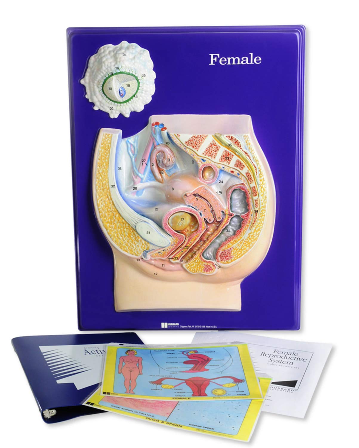 Female Reproductive Model Labeled