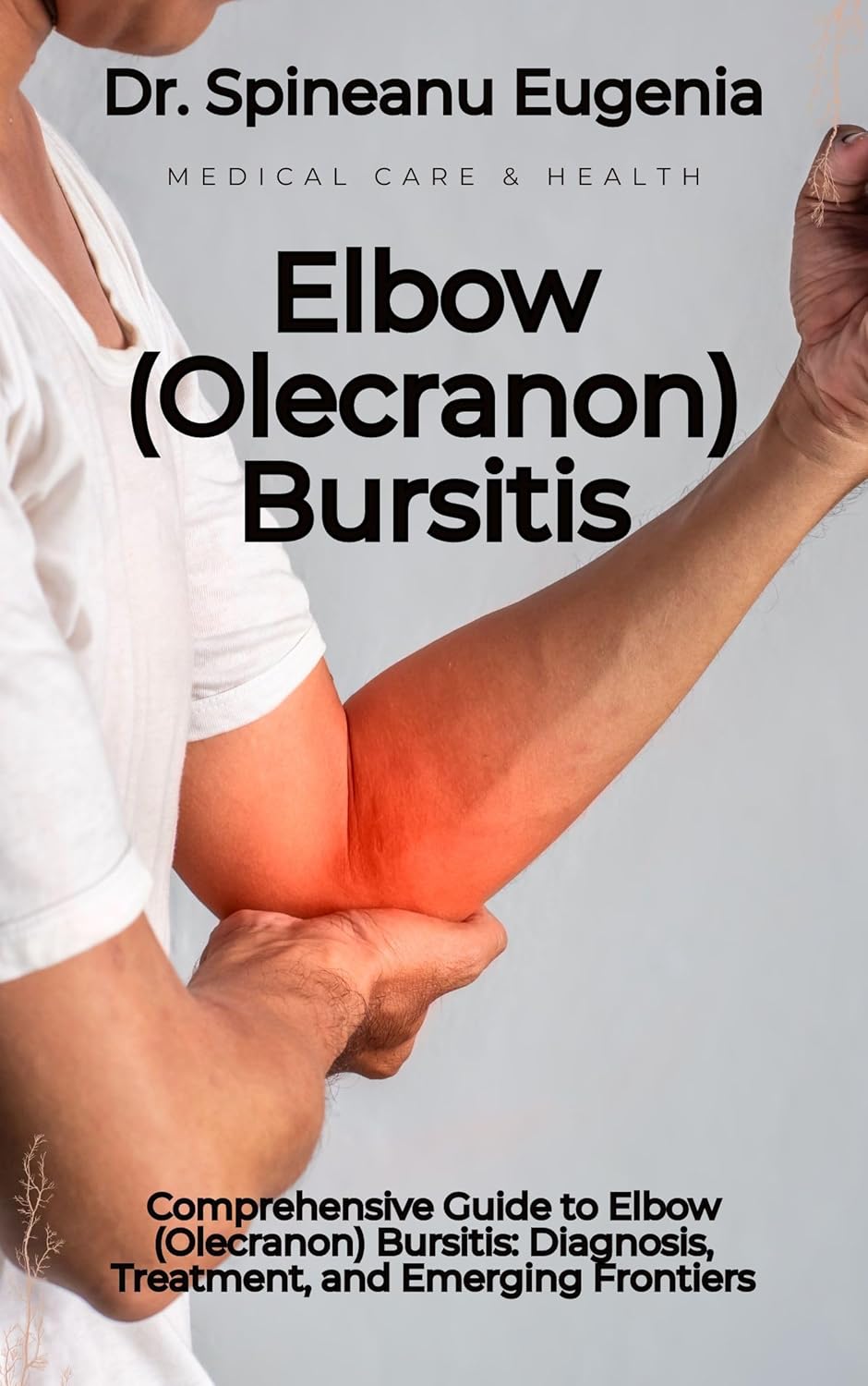 Amazon.com: Comprehensive Guide to Elbow (Olecranon) Bursitis: Diagnosis, Treatment, and ...