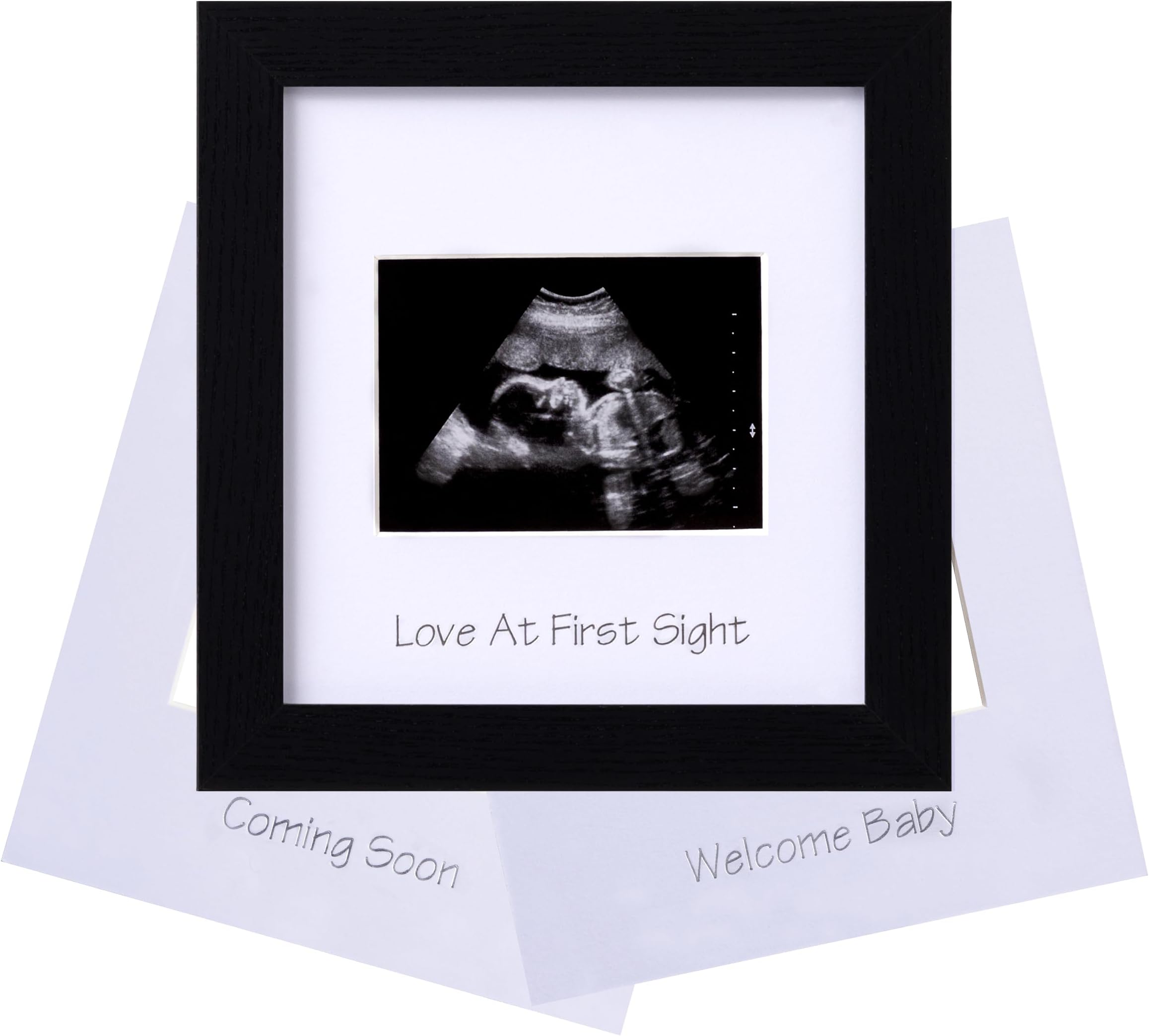 Amazon.com: Juvale White Sonogram Keepsake Frame for 4 x 3 Ultrasound ...