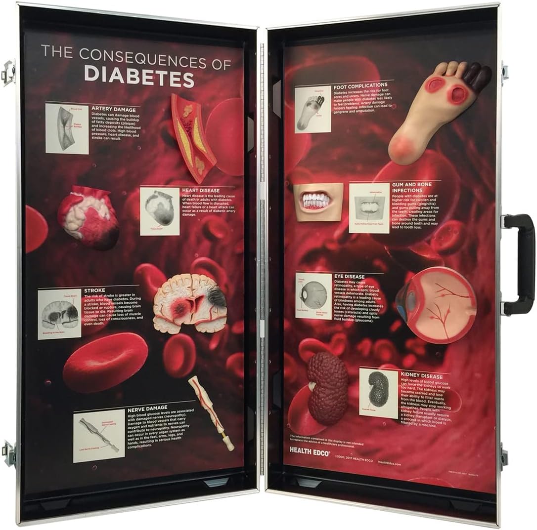 Health Edco Consequence of Diabetes : Buy Online at Best Price in KSA ...